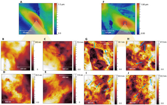 Ultrastructural Analysis of Cancer Cells Treated with the ...