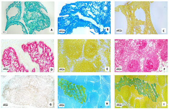 Novel Chromogens for Immunohistochemistry in Spatial Biology