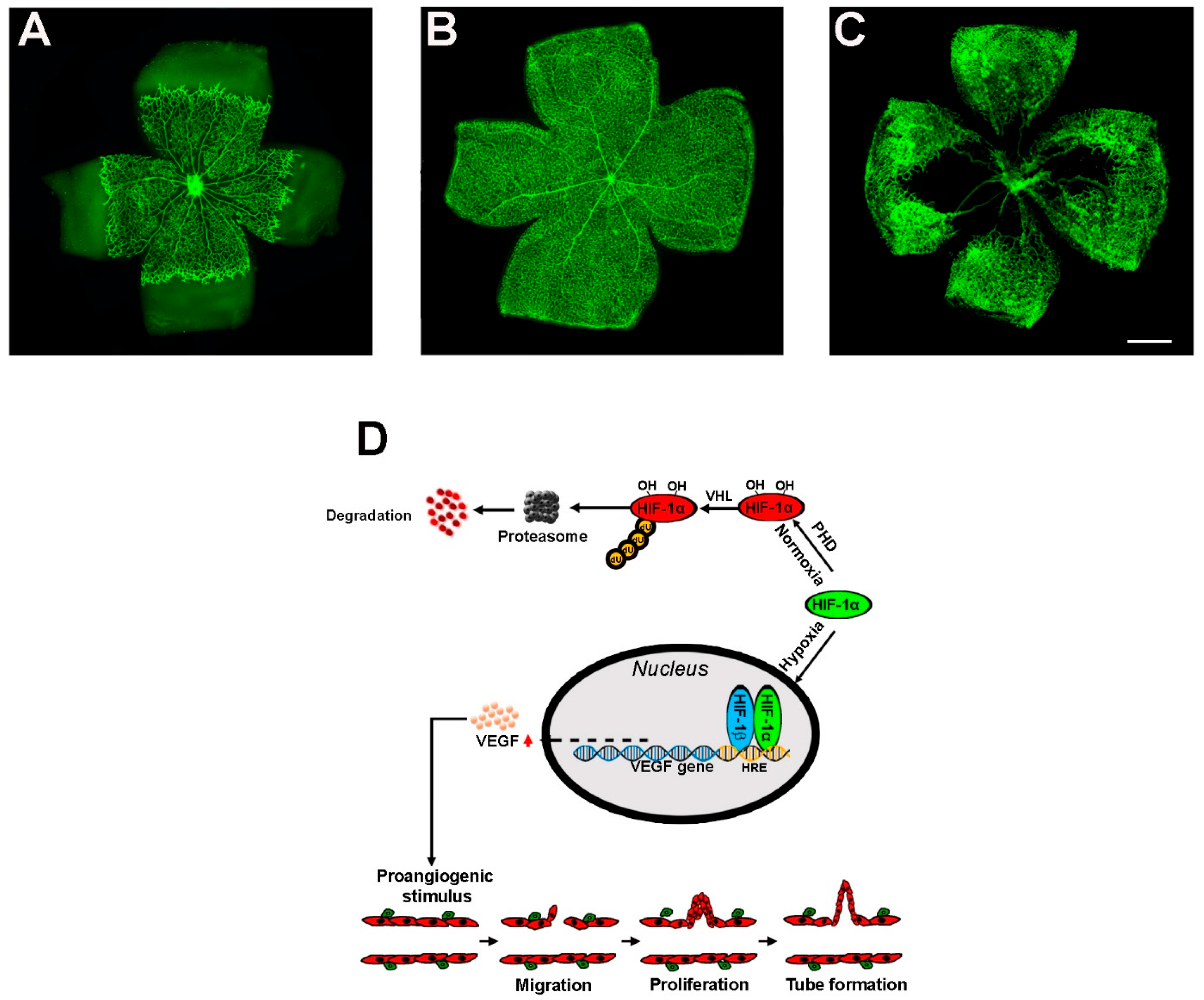 The Long-Standing Problem of Proliferative Retinopathies: Current Understanding and Critical Cues