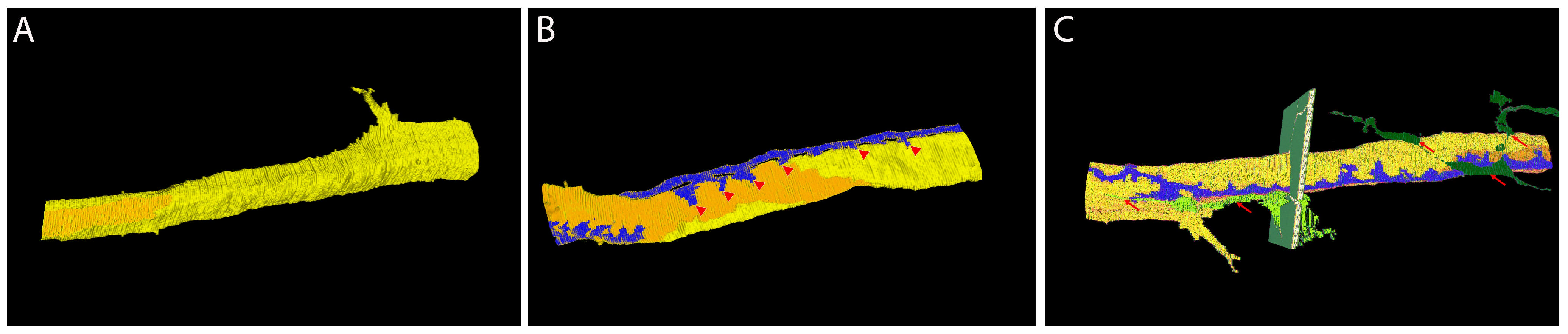Three-Dimensional Visualization of the Cardiac Stroma