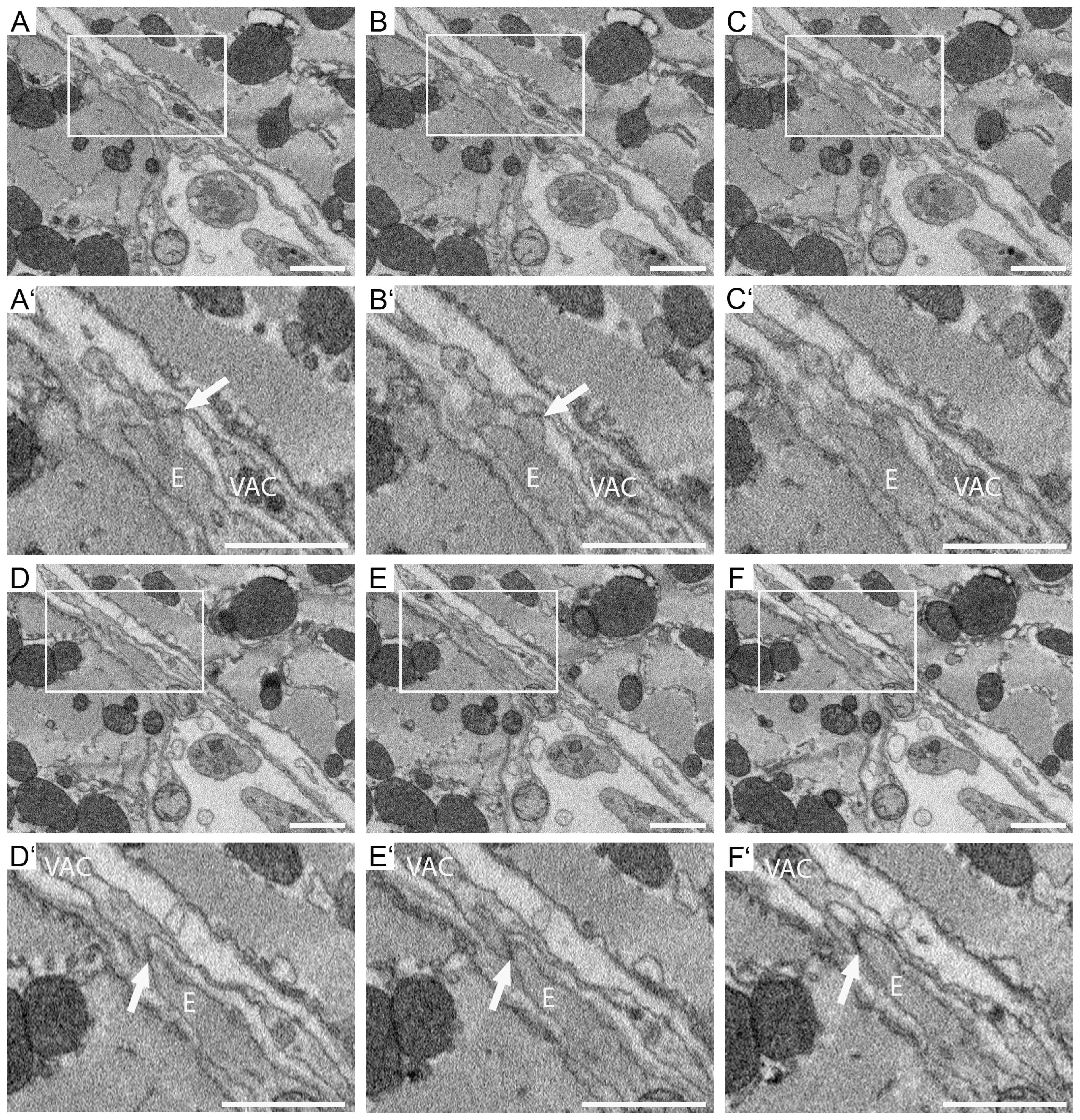 Three-Dimensional Visualization of the Cardiac Stroma