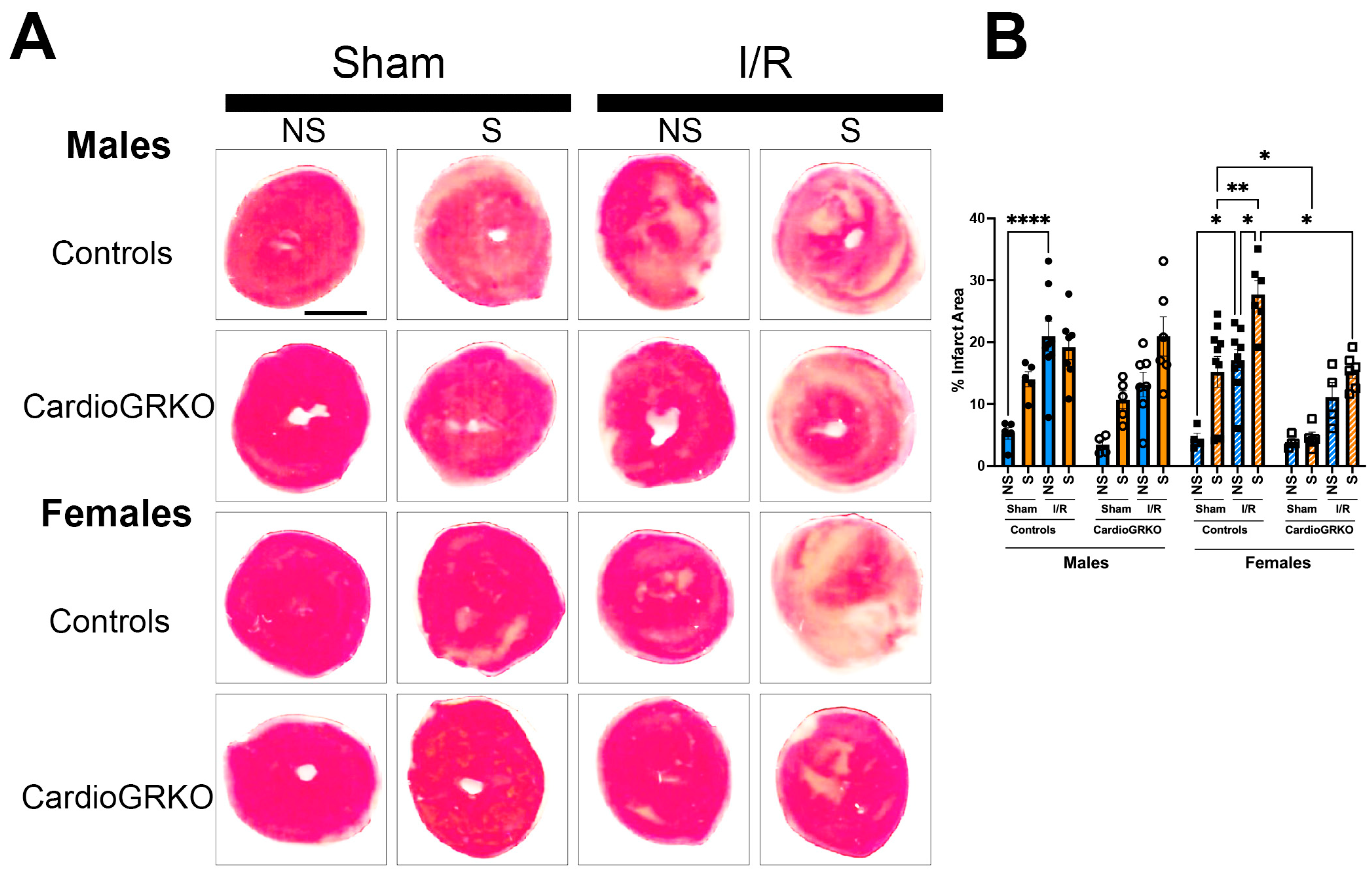 Cardiomyocyte Glucocorticoid Receptors Exacerbate Stress Effects in ...