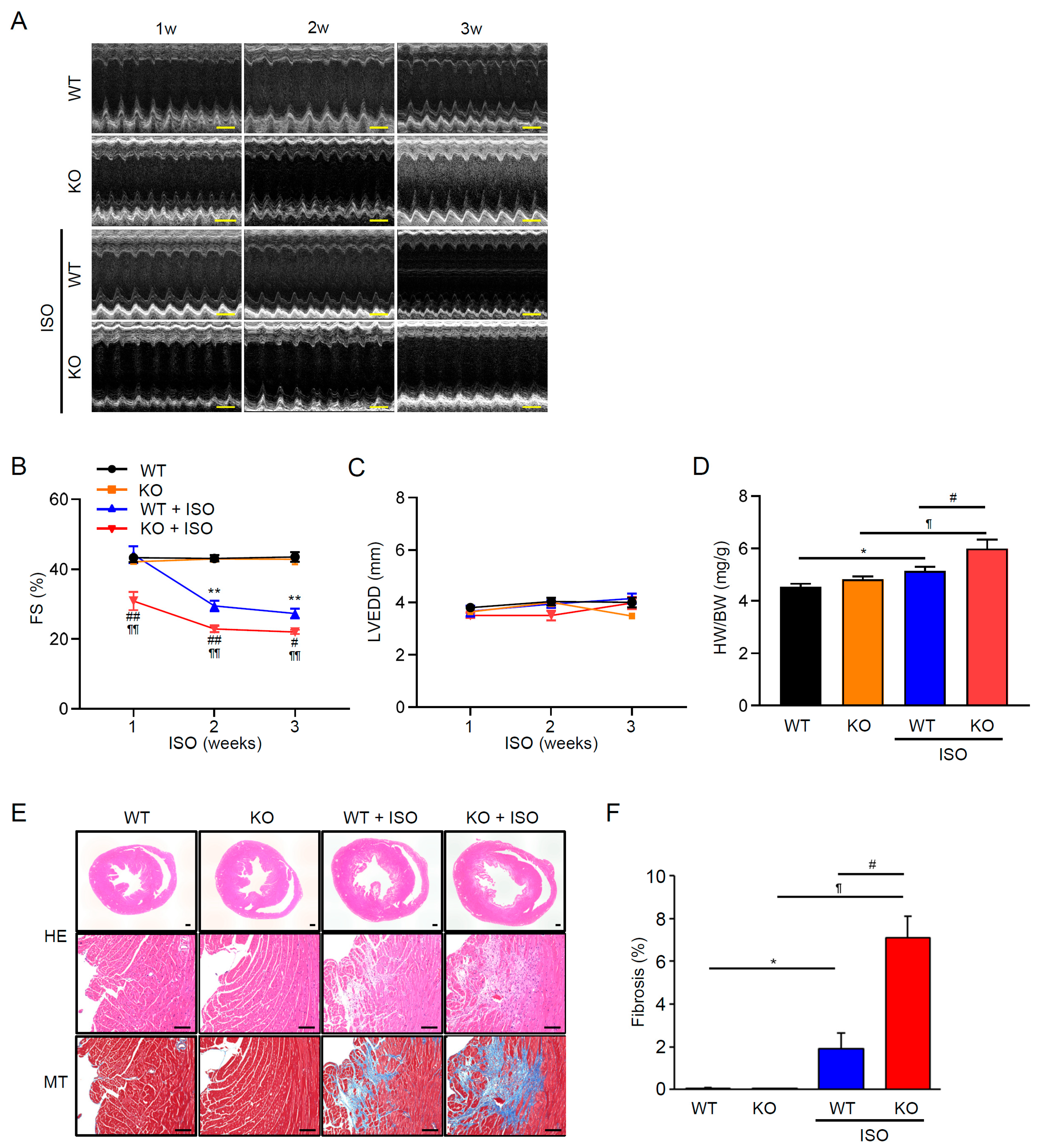Atrial TRPM2 Channel-Mediated Ca2+ Influx Regulates ANP Secretion and ...