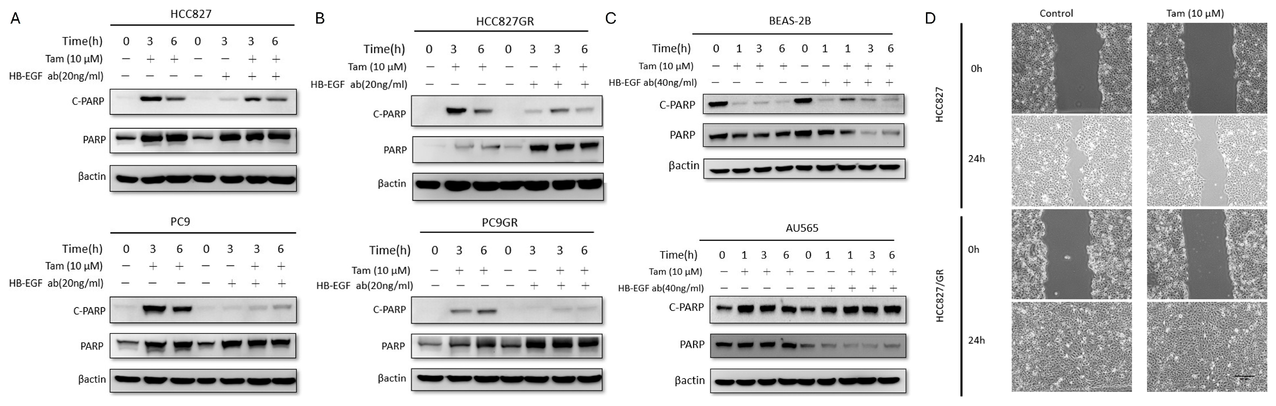 The Crosstalk Mechanism of EGFR and ER in EGFR-Mutant Lung Adenocarcinoma