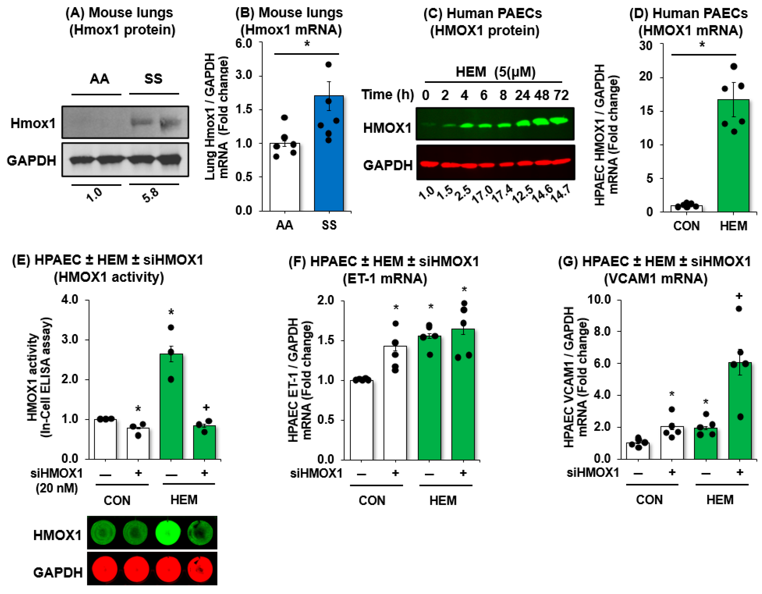 Long Non-Coding RNA MALAT1 Regulates HMOX1 in Sickle Cell Disease ...