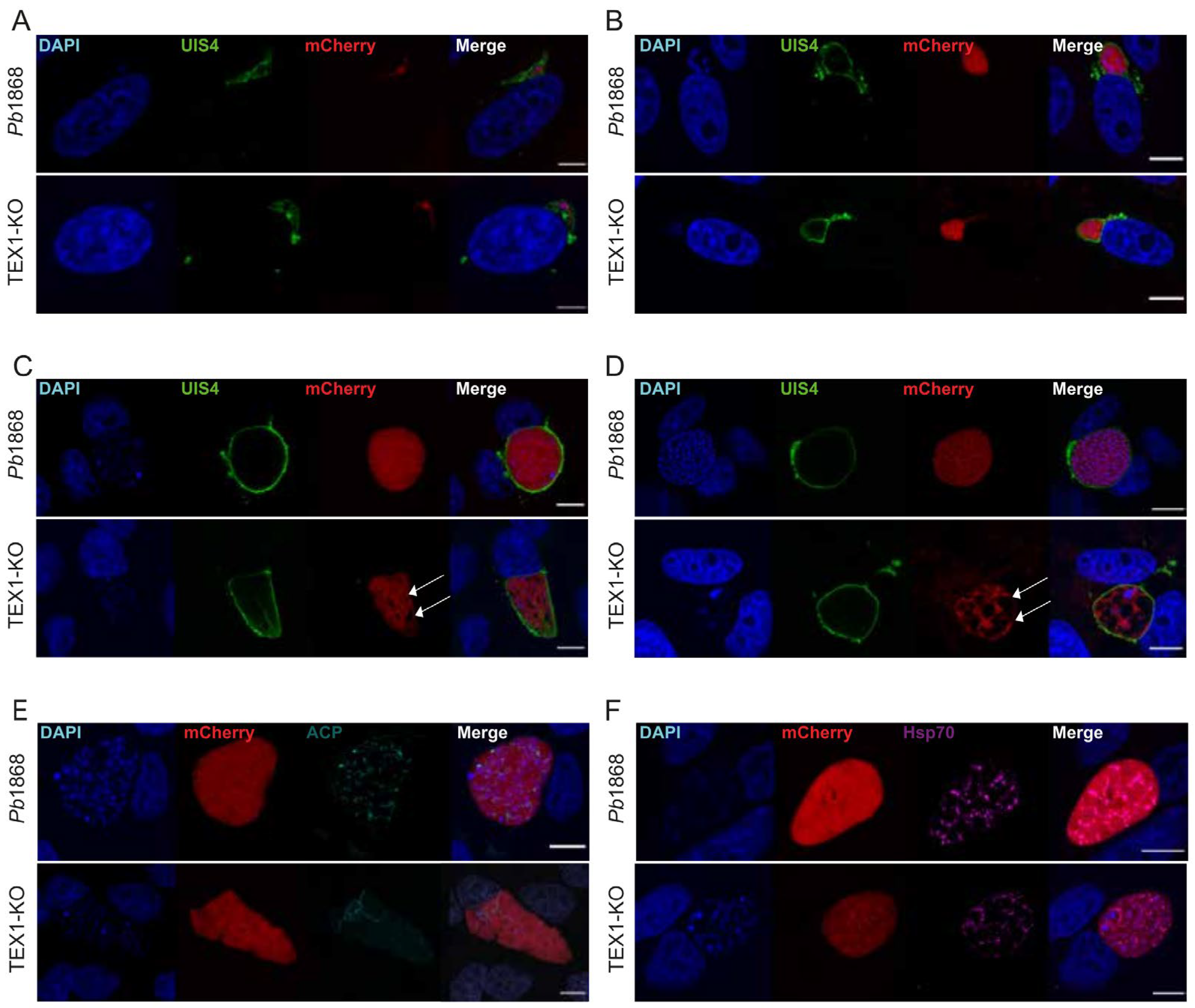 The Putative E3 Ubiquitin Ligase TEX1 Is Required for Nuclear Biology ...