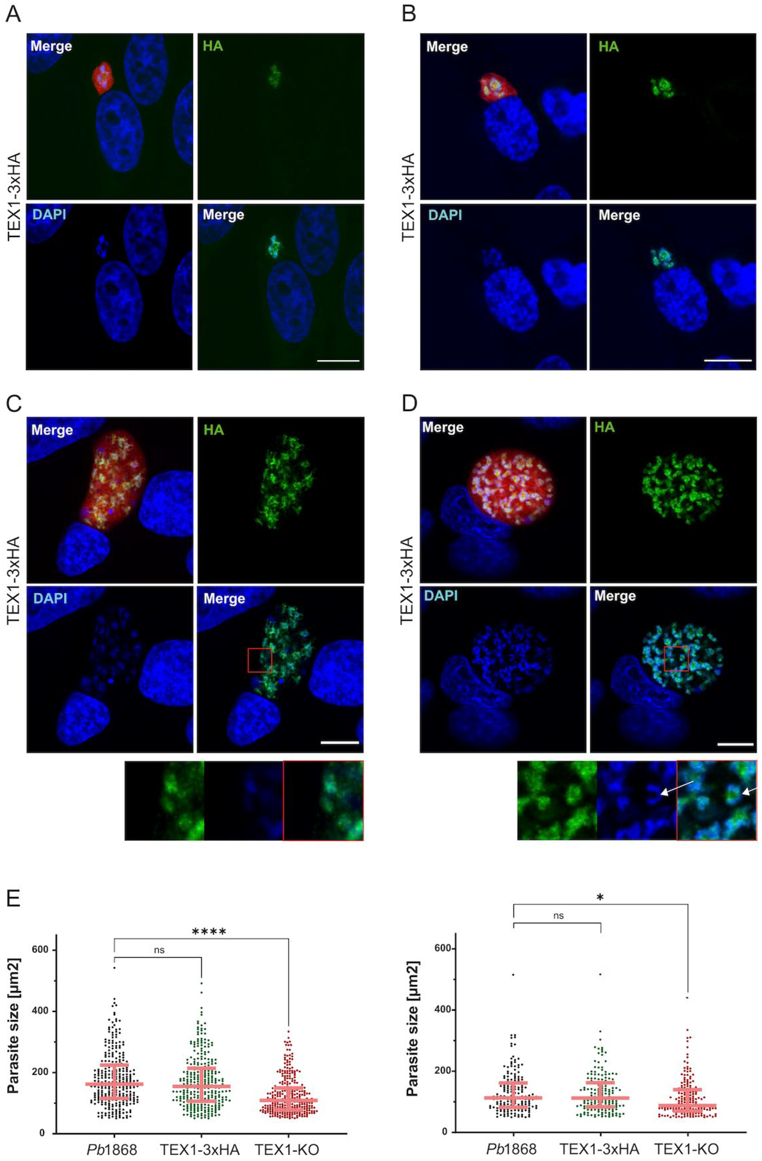 The Putative E3 Ubiquitin Ligase TEX1 Is Required for Nuclear Biology ...