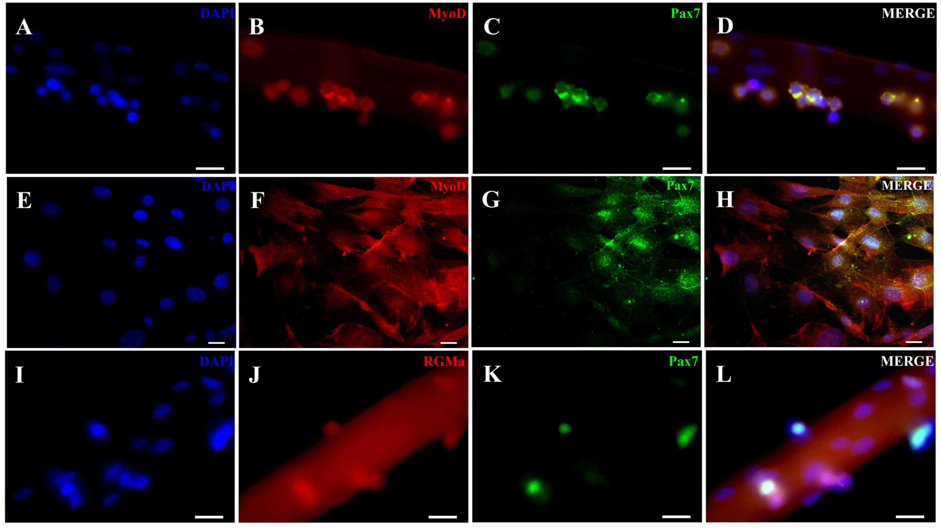RGMa Nuclear Localization in Skeletal Muscle Cells Reveals a Novel Role ...