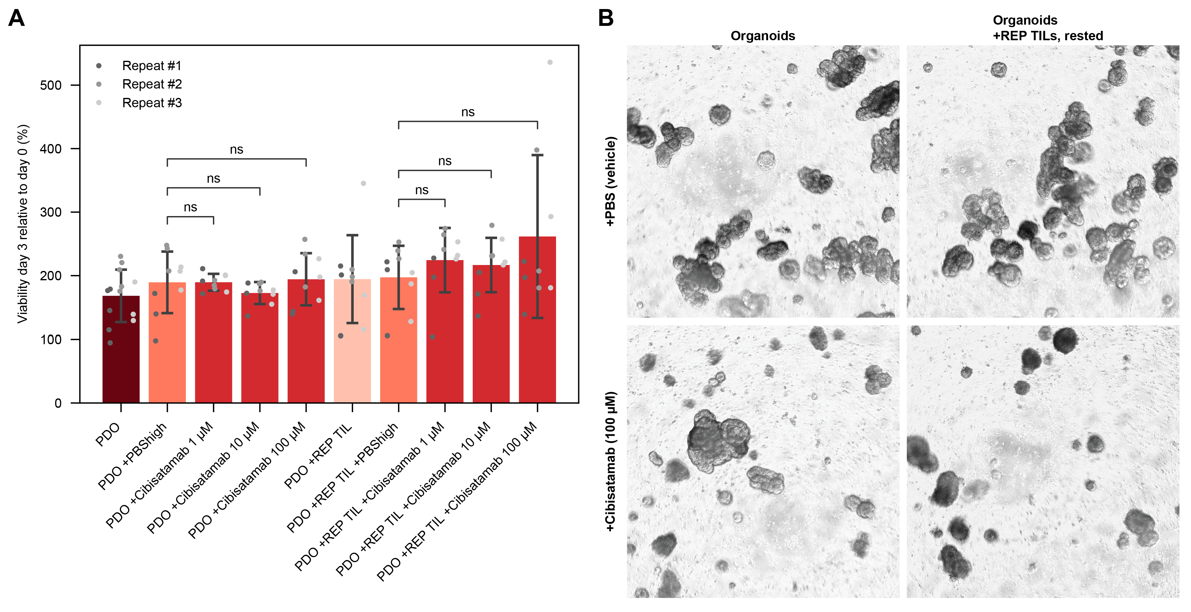 Immune Cell Modulation of Patient-Matched Organoid Drug Response in ...