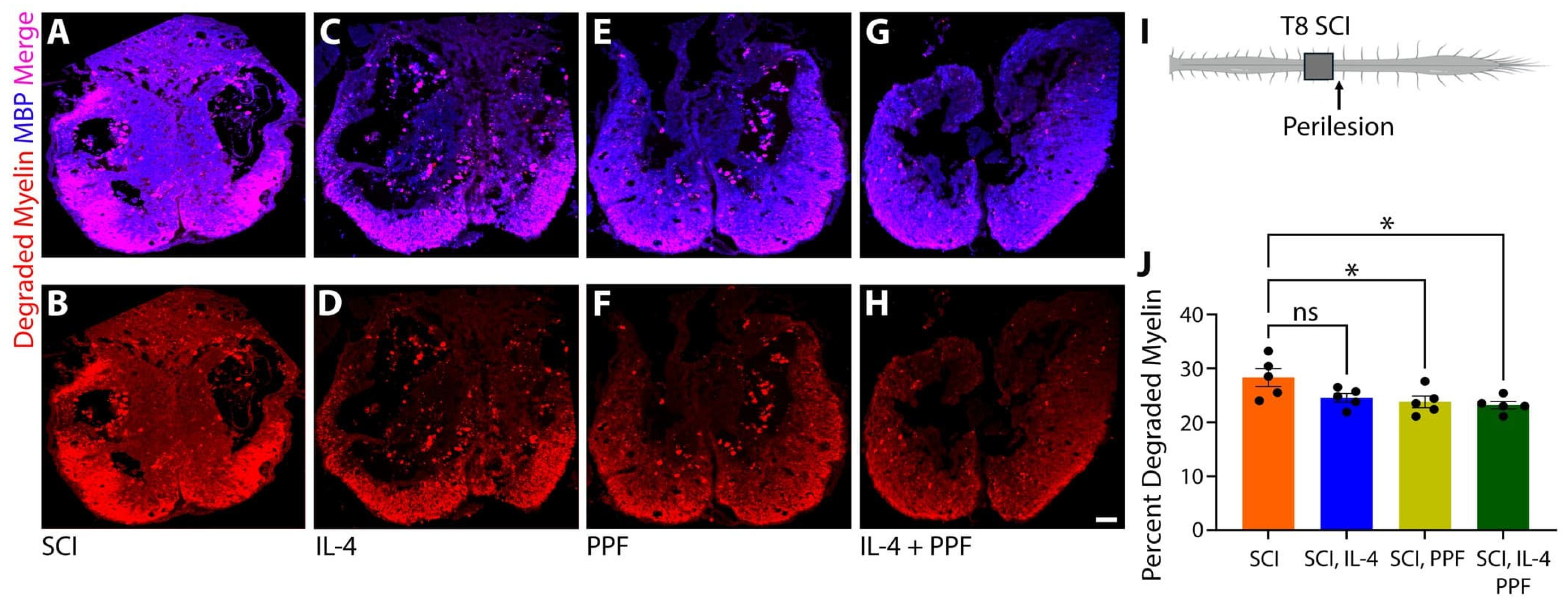 Propentofylline and Interleukin-4 Modulate Lesion-Associated Myeloid ...