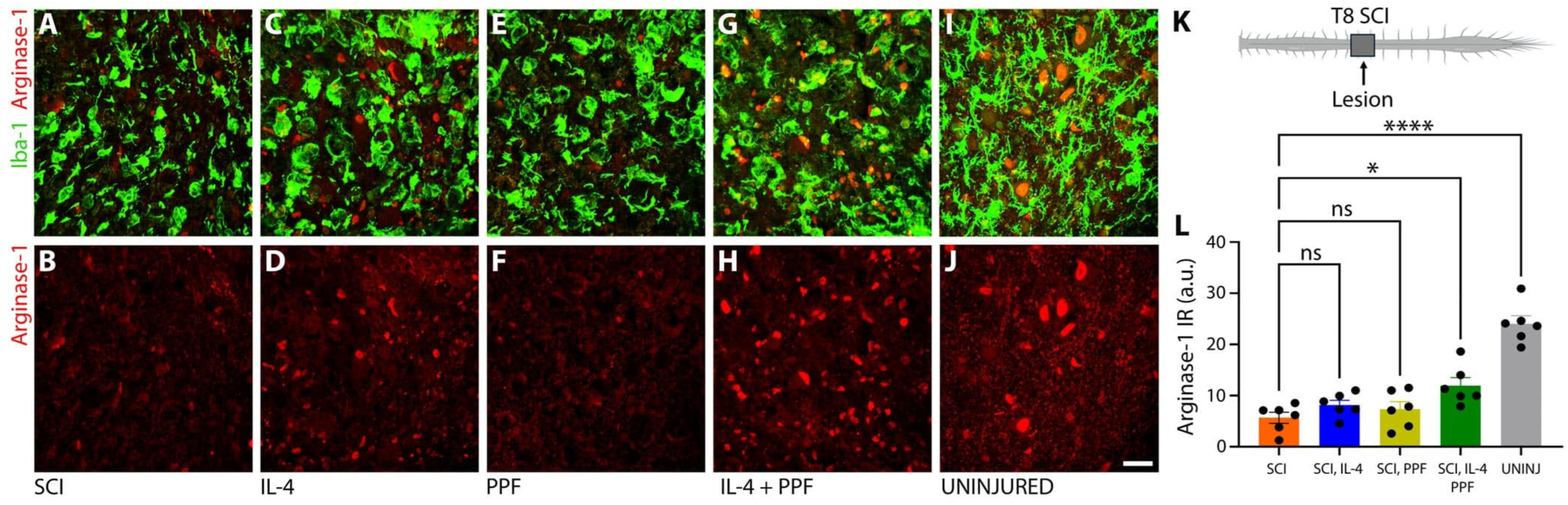 Propentofylline and Interleukin-4 Modulate Lesion-Associated Myeloid ...