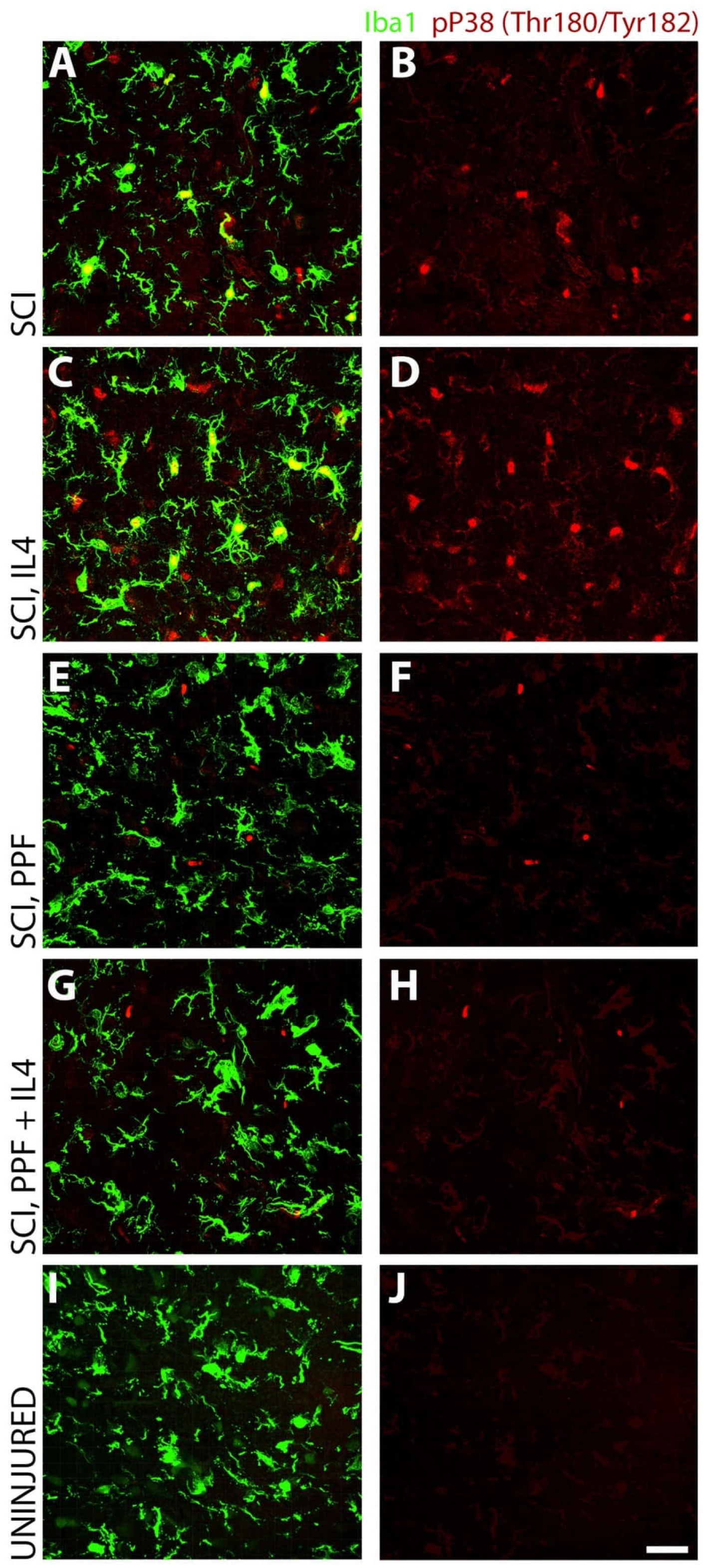 Propentofylline and Interleukin-4 Modulate Lesion-Associated Myeloid ...