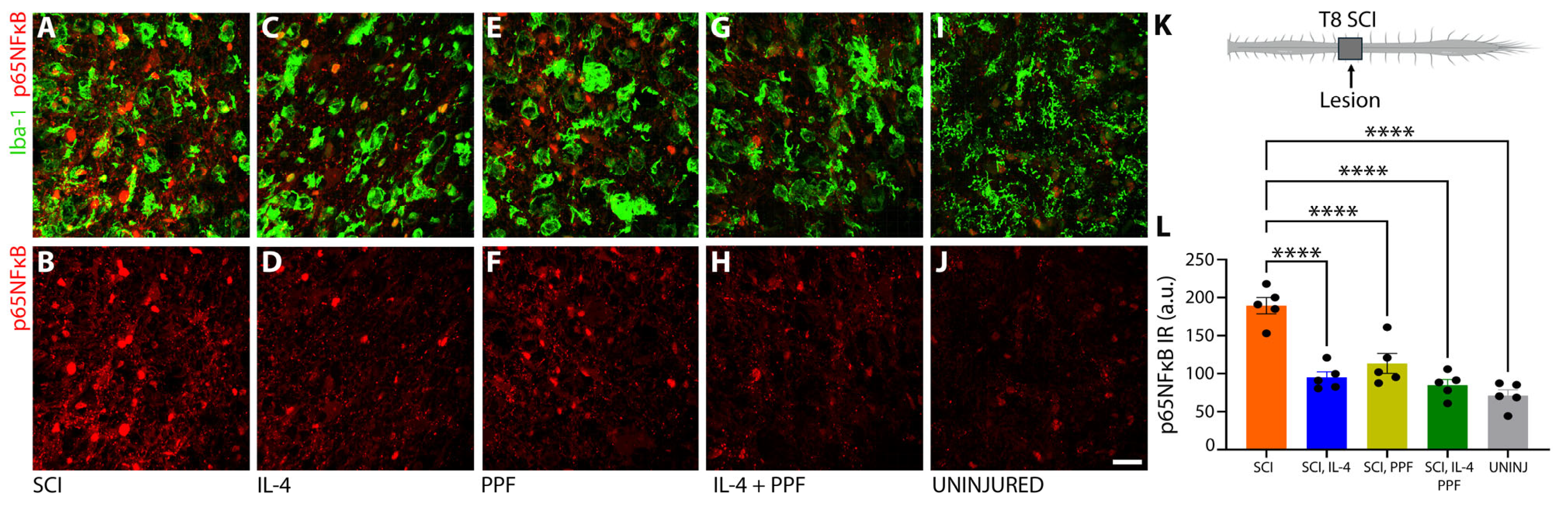 Propentofylline and Interleukin-4 Modulate Lesion-Associated Myeloid ...