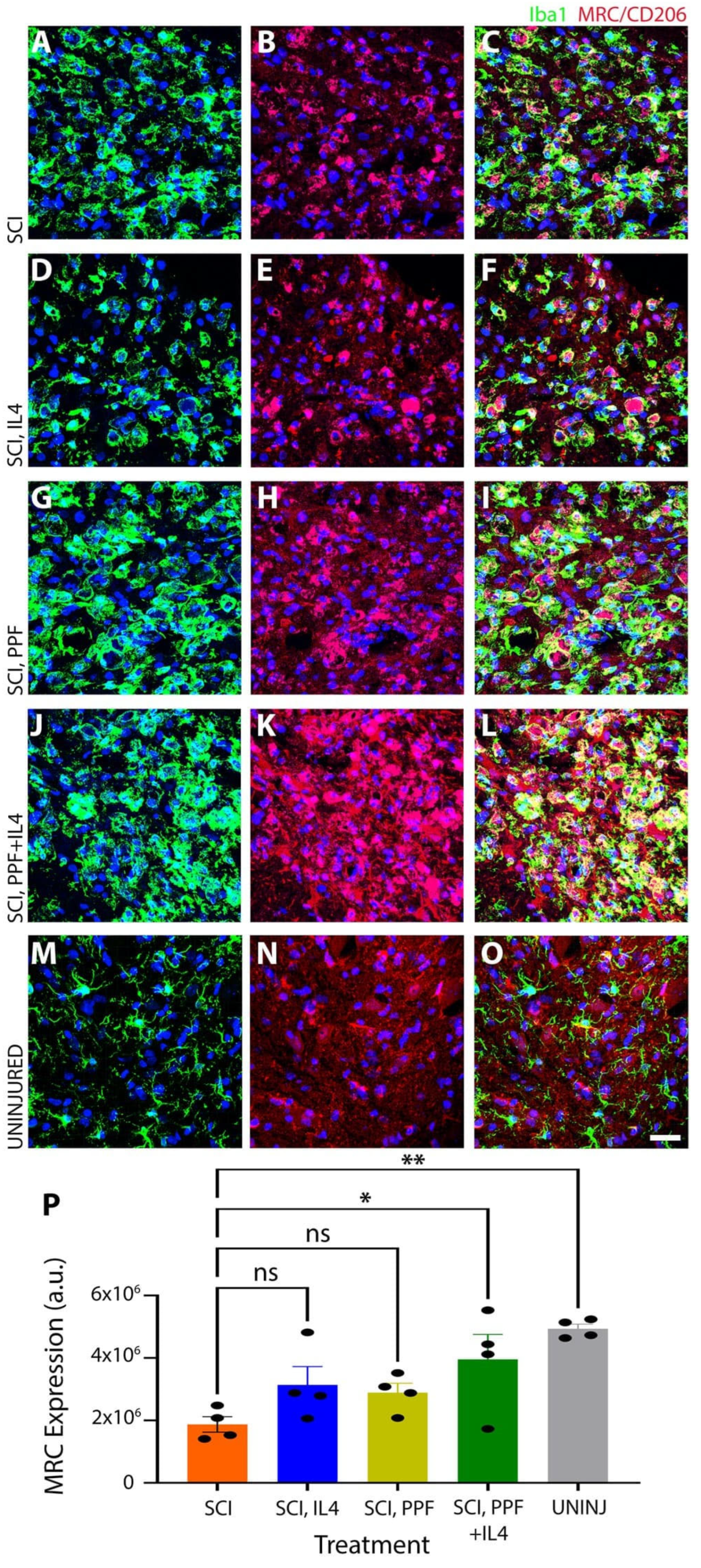 Propentofylline and Interleukin-4 Modulate Lesion-Associated Myeloid ...