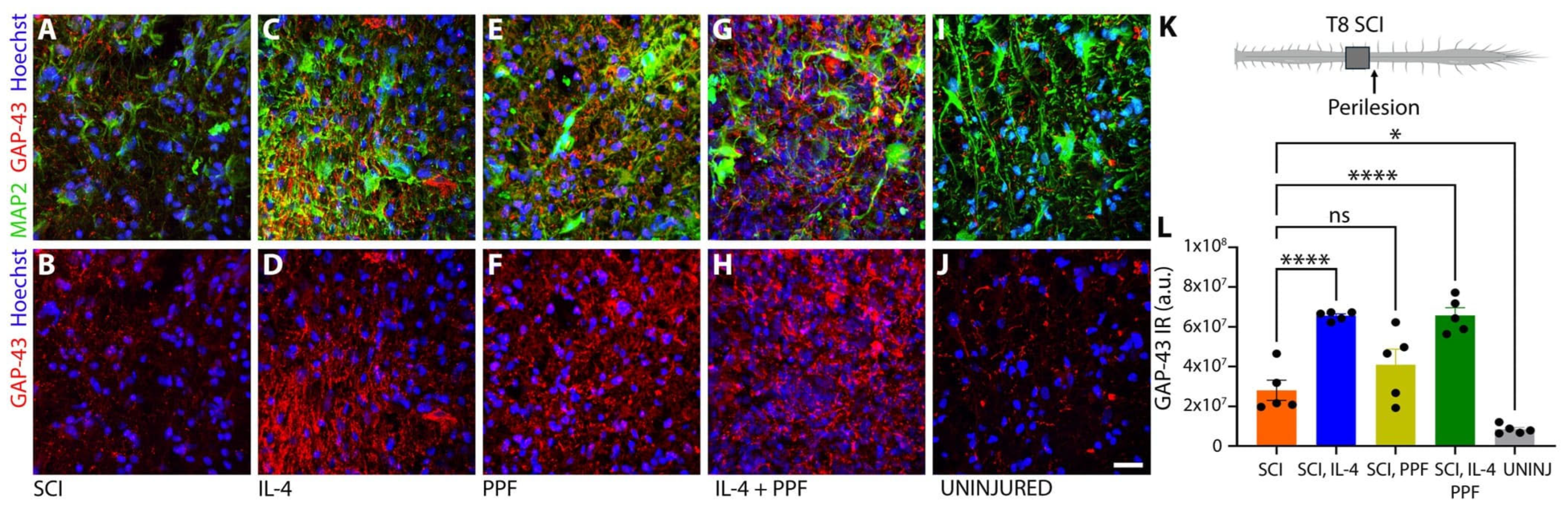 Propentofylline and Interleukin-4 Modulate Lesion-Associated Myeloid ...