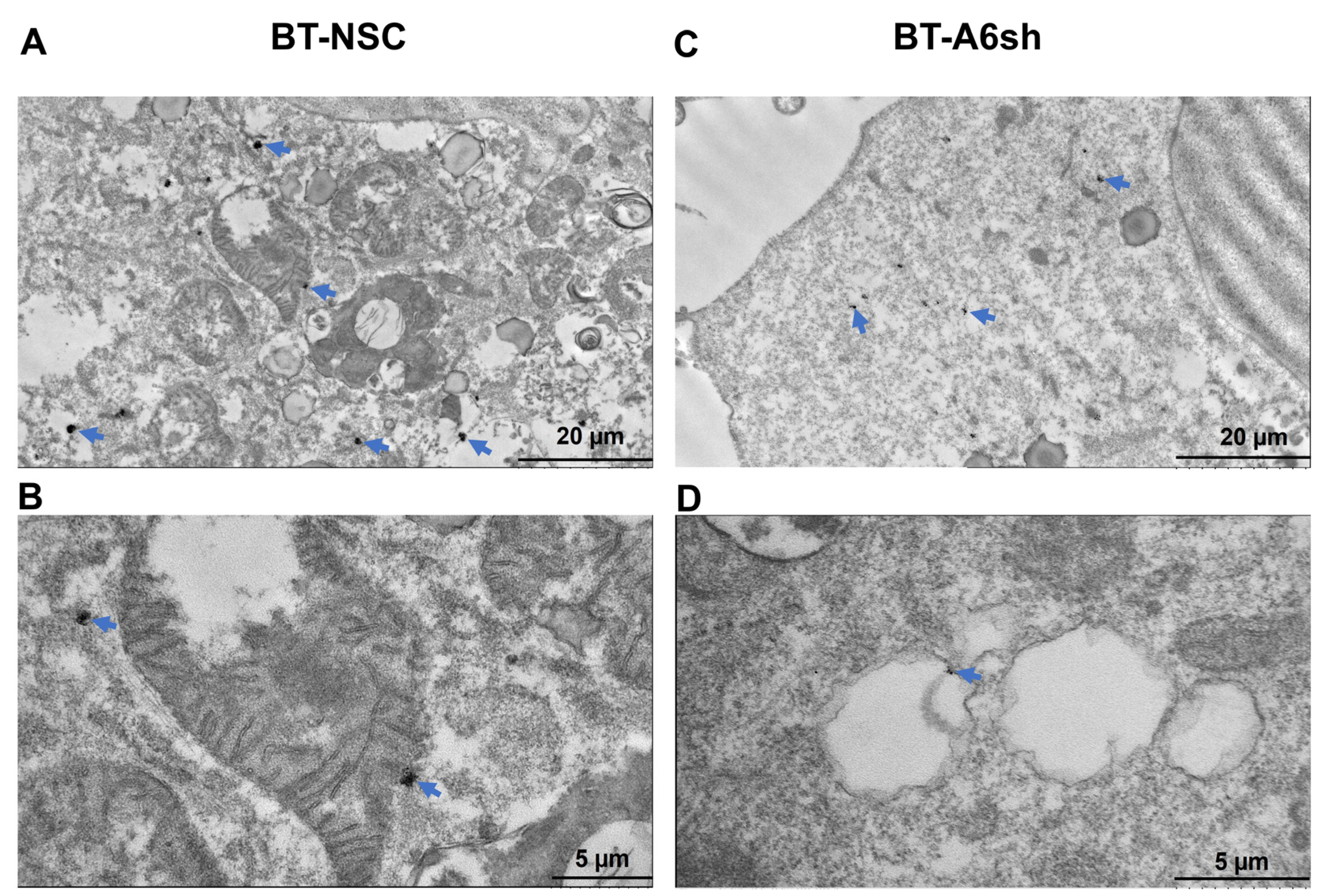 Annexin A6 Modulates the Secretion of Pro-Inflammatory Cytokines and ...