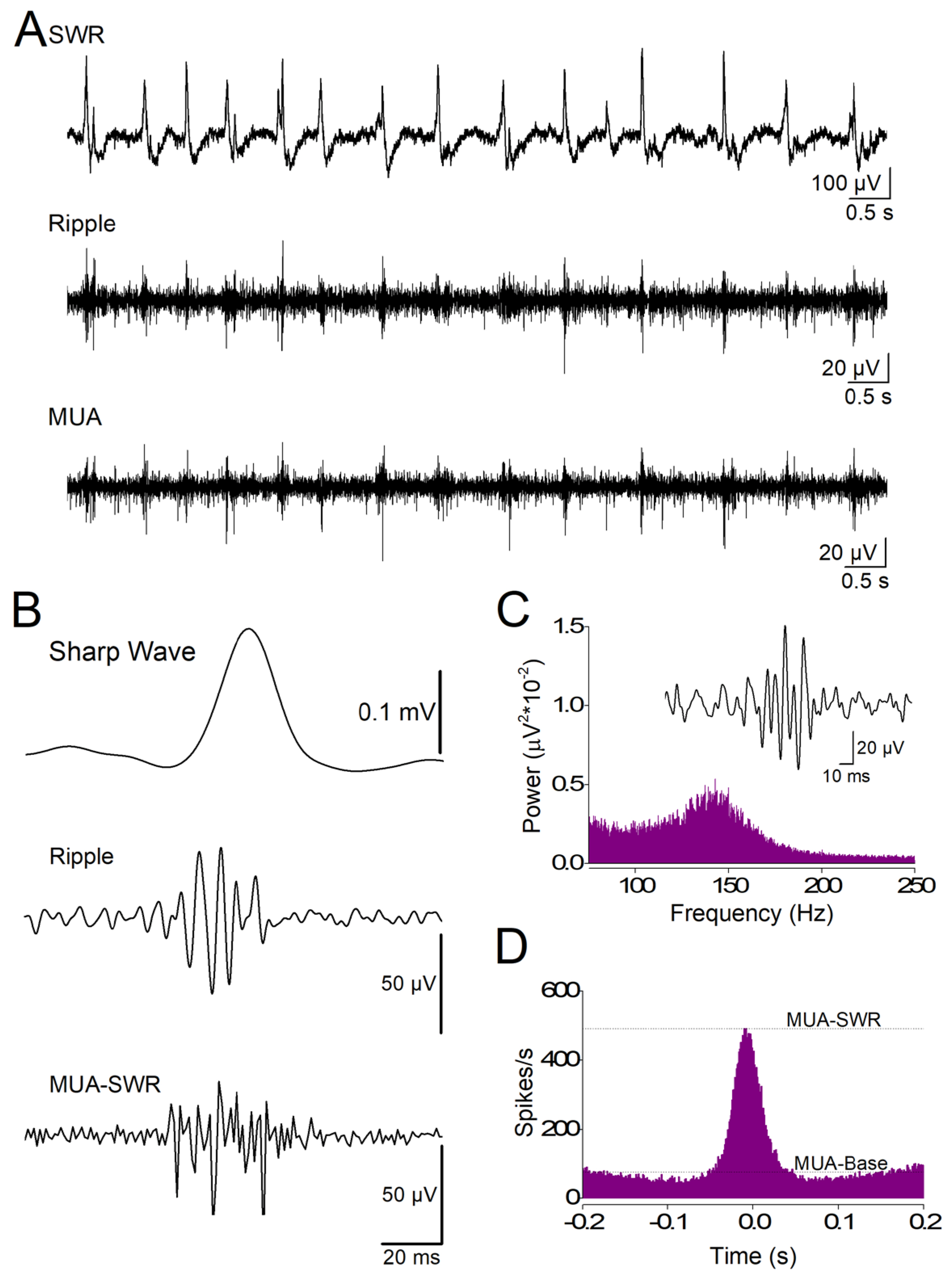 Sex- and Region-Dependent Differences in Sharp Wave–Ripples Along the ...