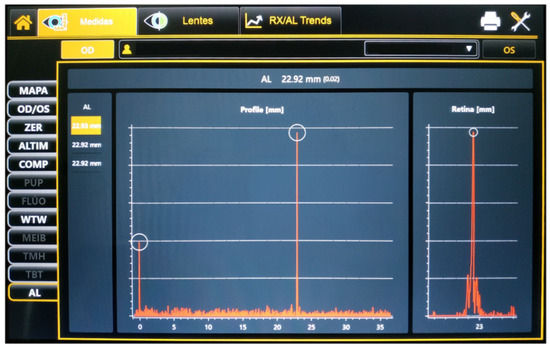 Clinical Validation of a New Optical Biometer for Myopia Control in a ...