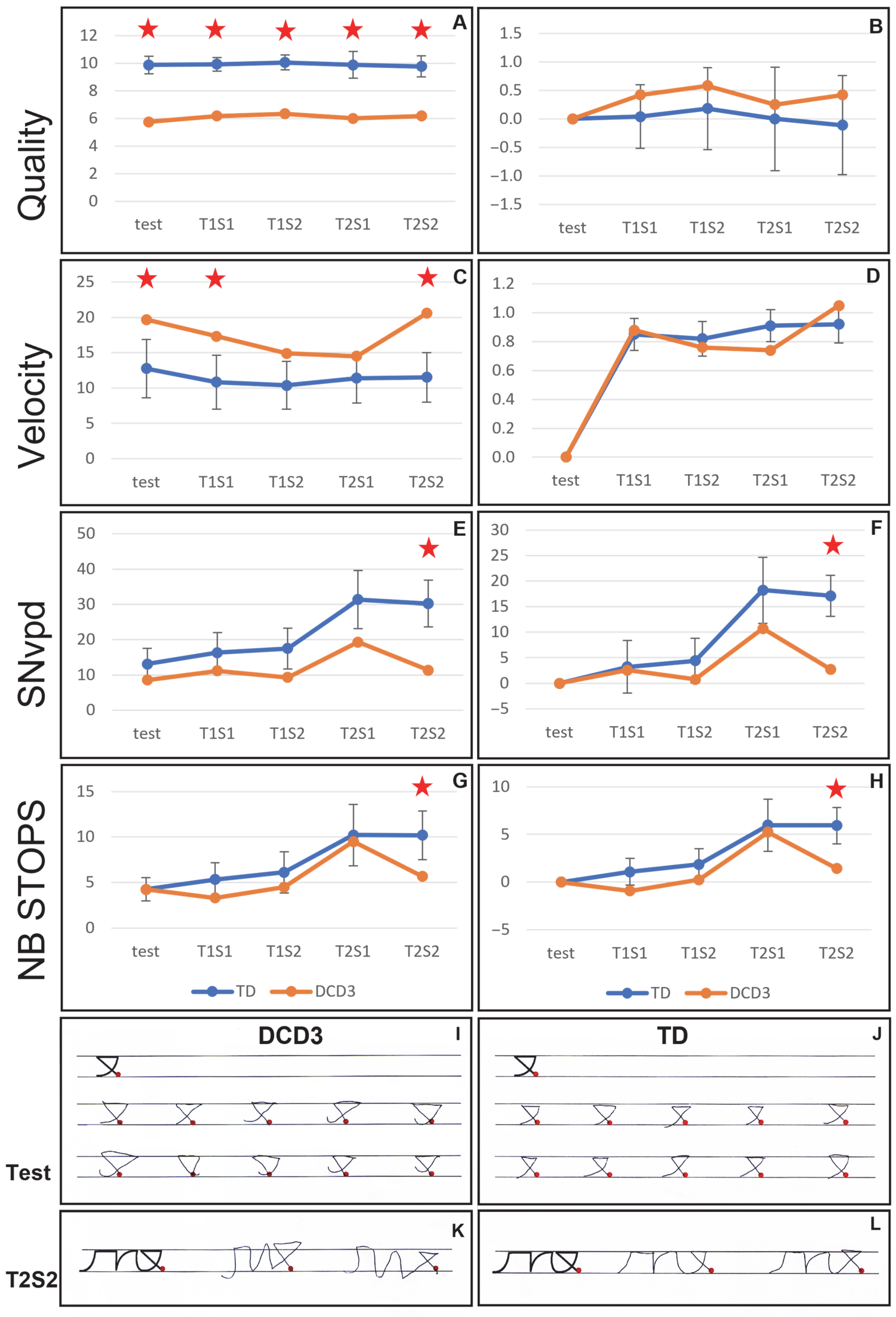 Learning and Transfer of Graphomotor Skills in Three 7- to 10-Year-Old ...