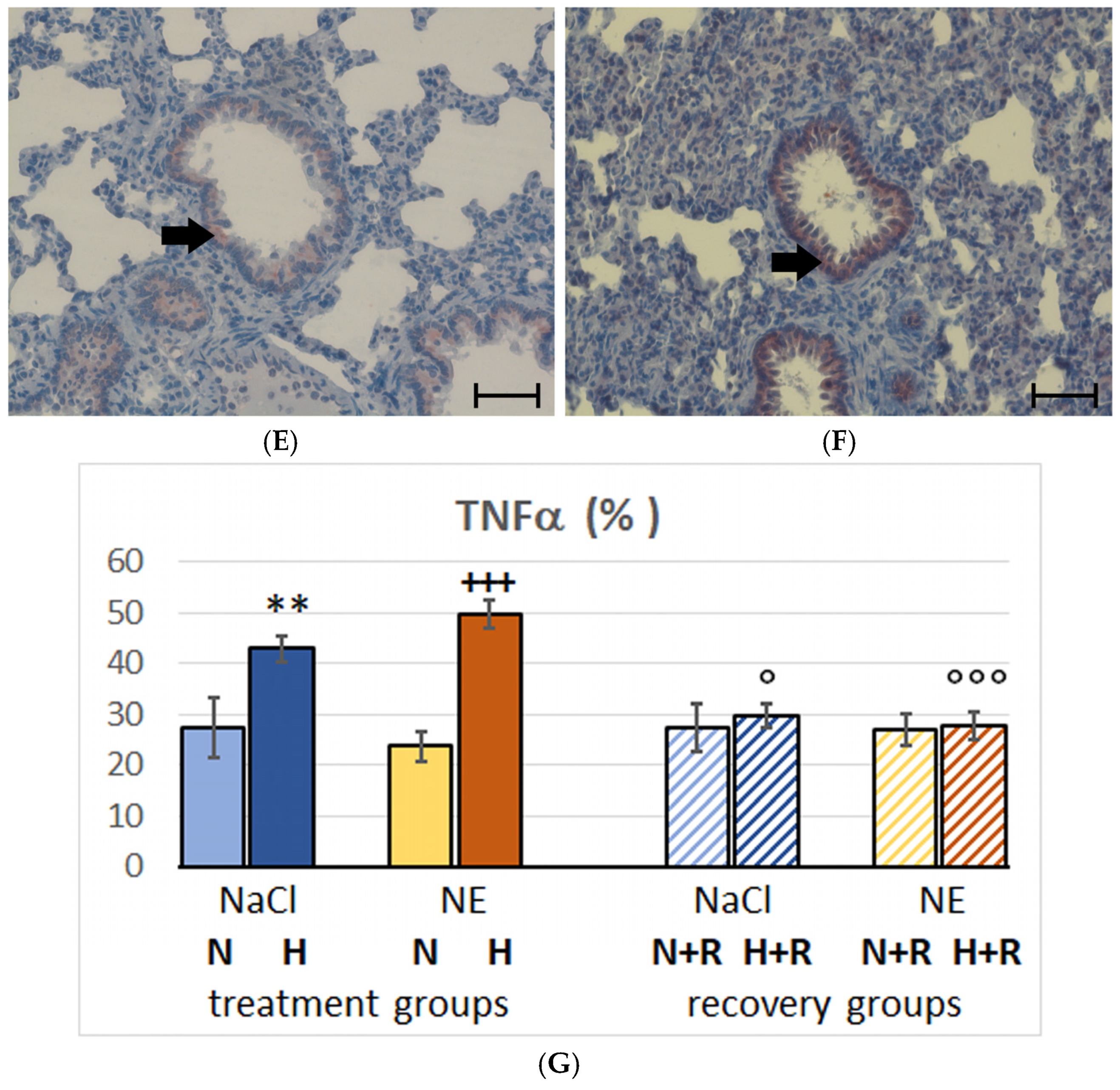 Can Damage to the Rat Lung Induced by Prolonged Normobaric Hypoxia and ...