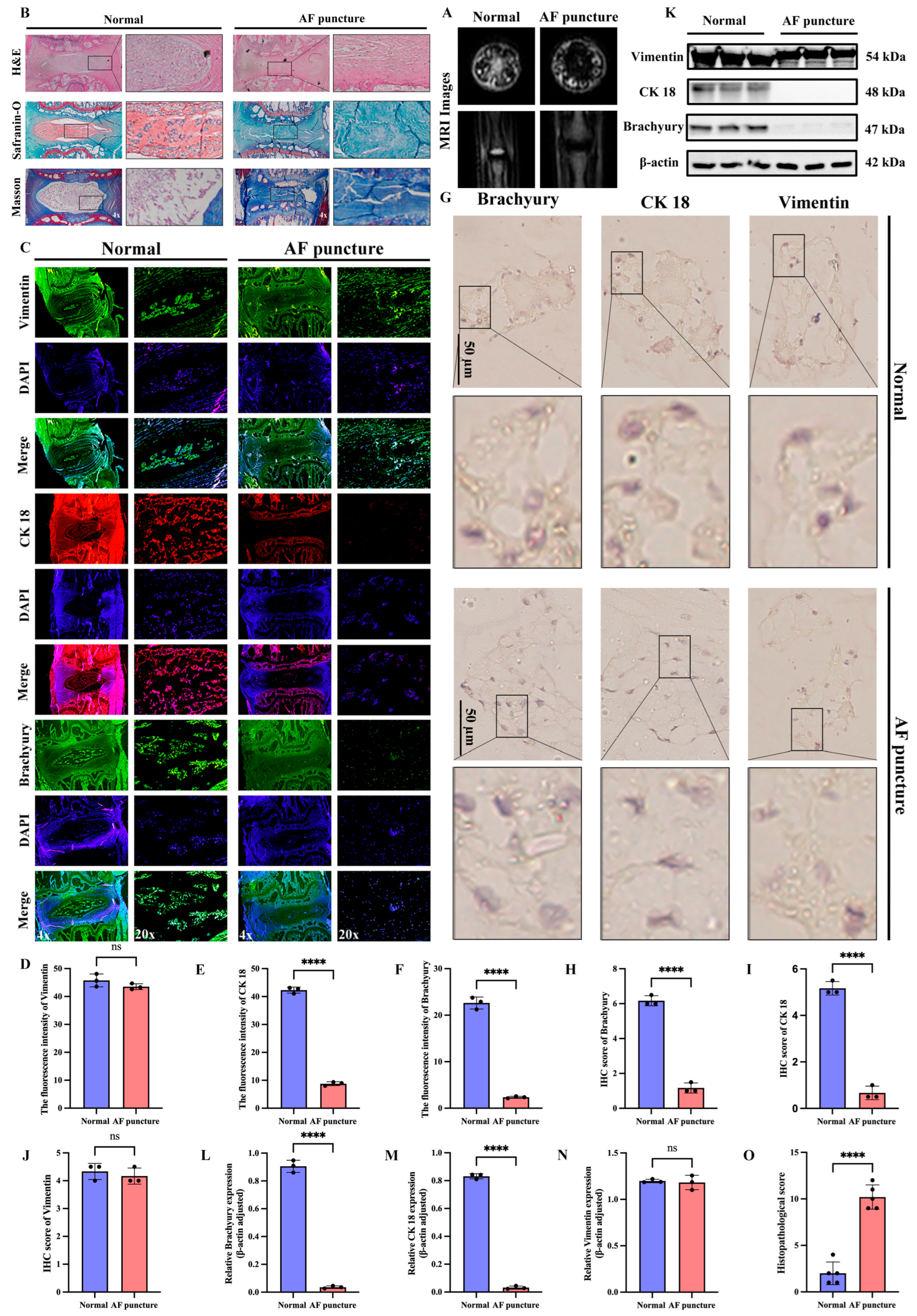 Comprehensive Transcriptomic Analysis and Experimental Validation of ...