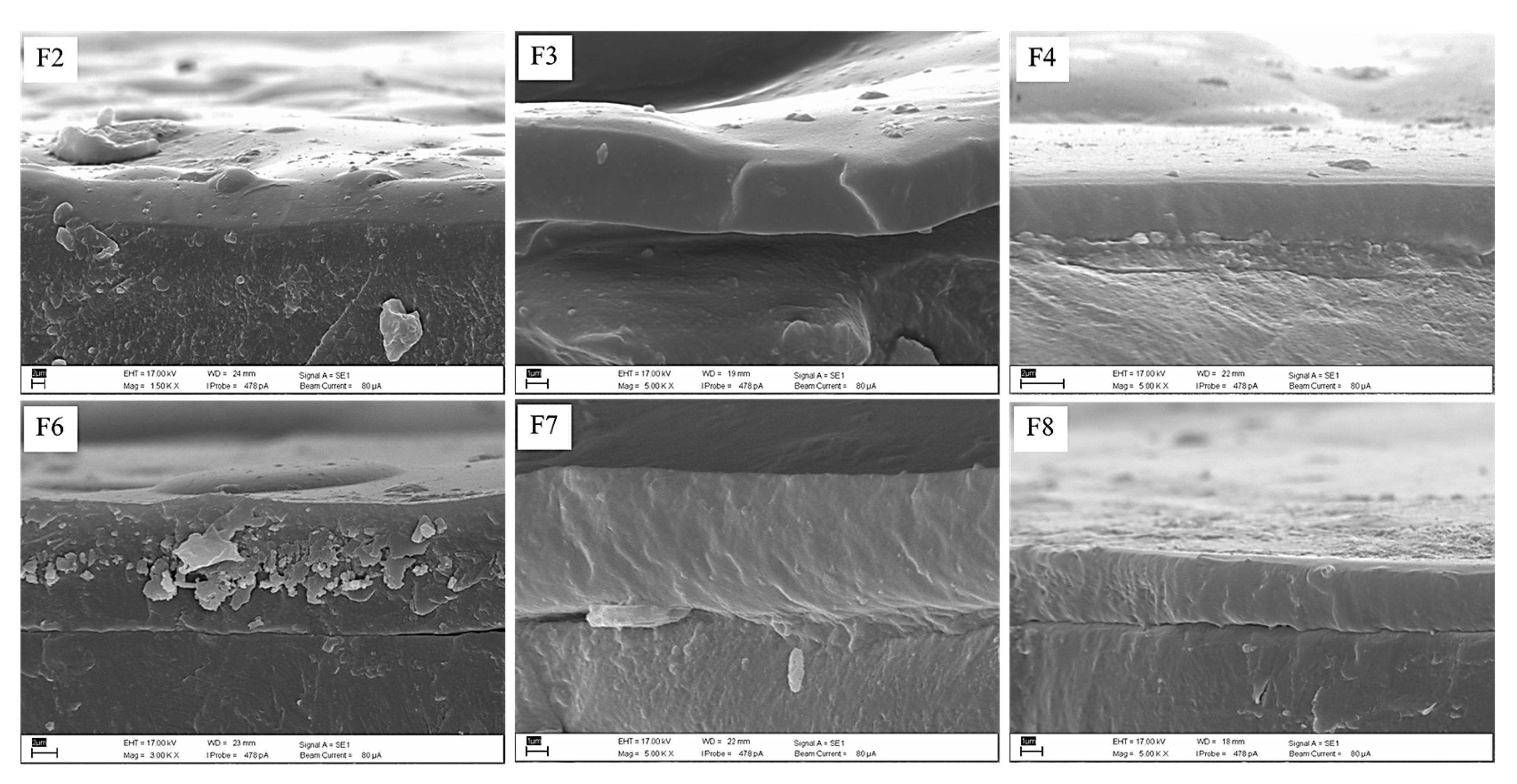 Synthesis and Application of AgNPs-Chitosan Composite as a Self ...