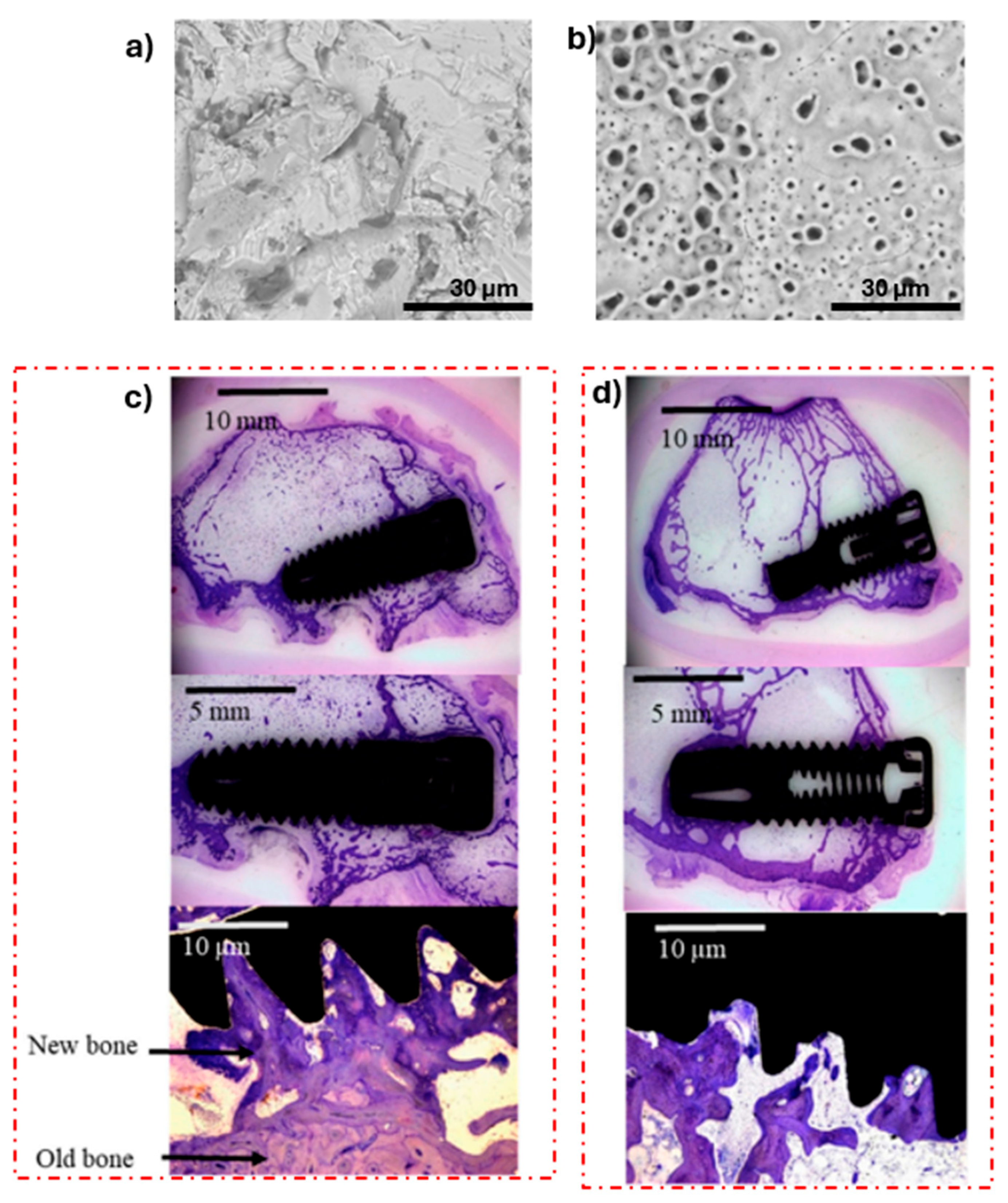 Surface Modification and Coating for Titanium Dental Implants: A Review ...