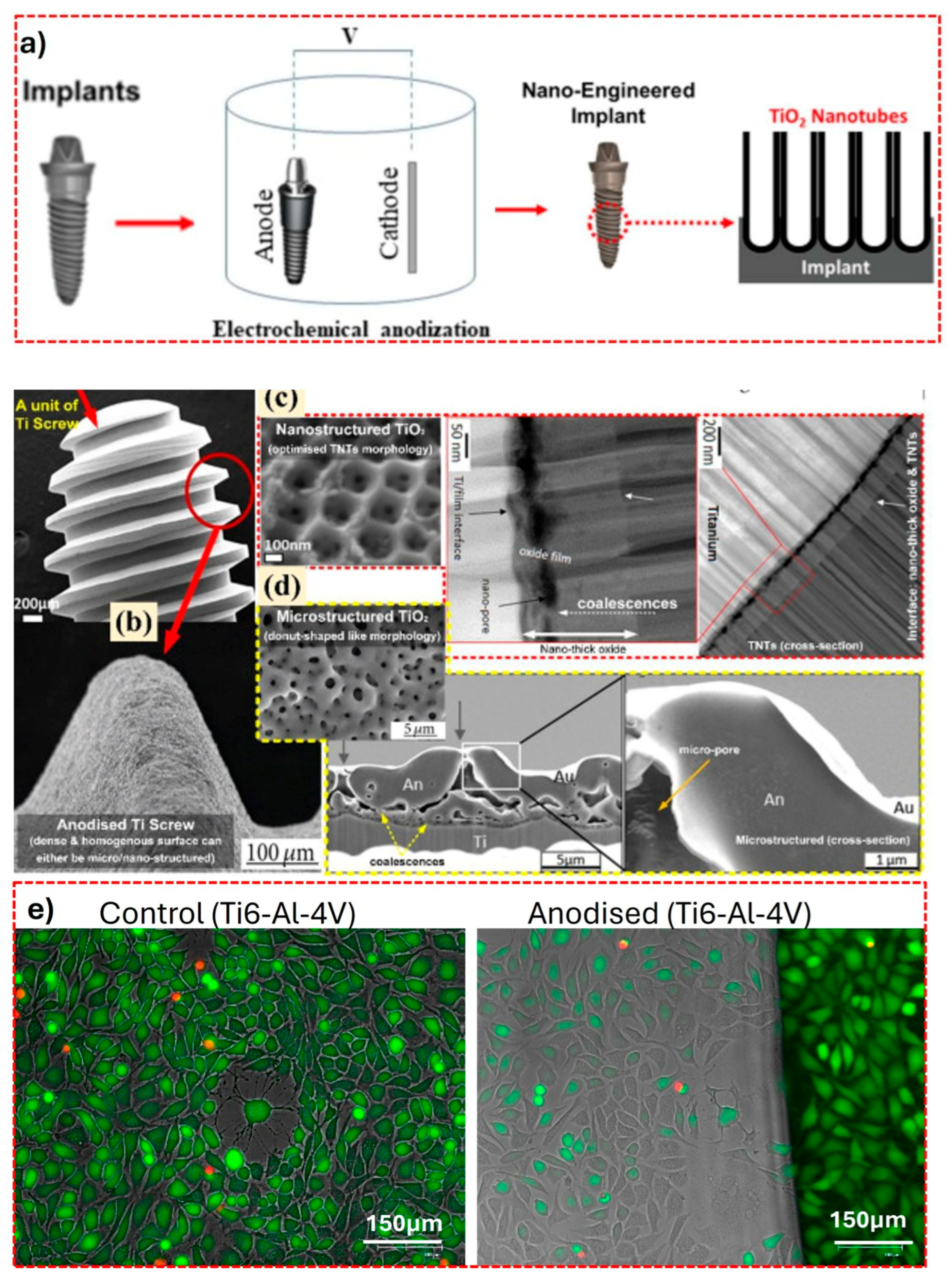 Surface Modification and Coating for Titanium Dental Implants: A Review ...