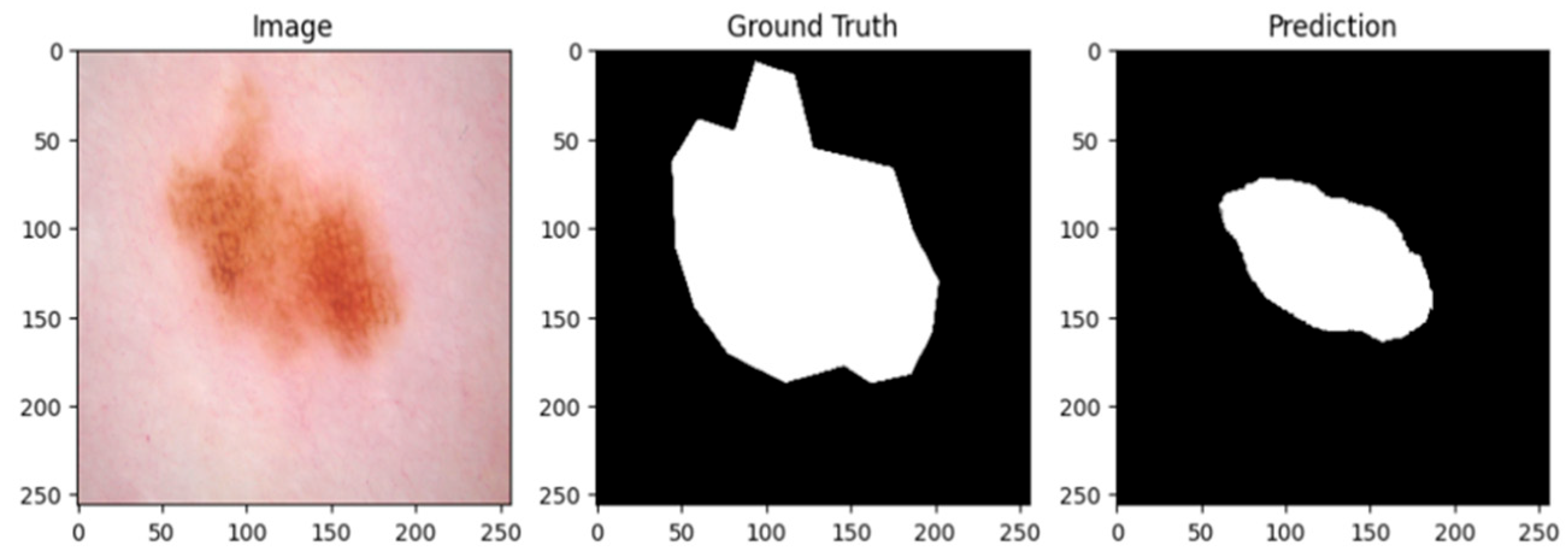 A Multiscale Convolutional Neural Network Framework for Automated ...