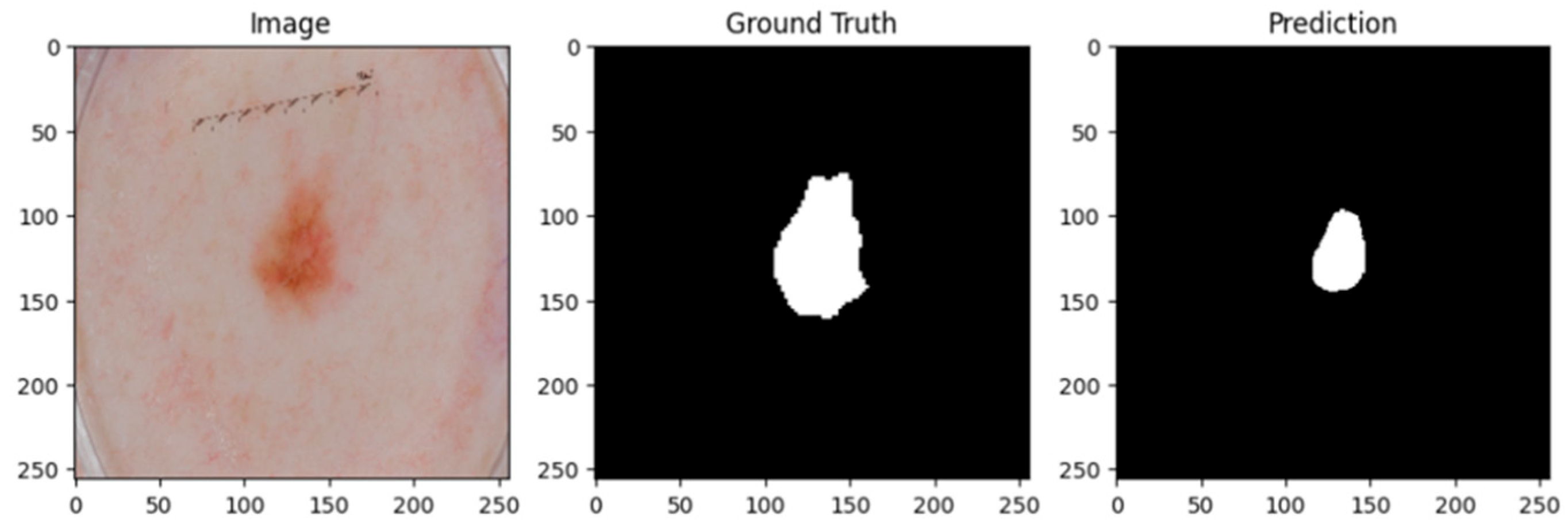 A Multiscale Convolutional Neural Network Framework for Automated ...