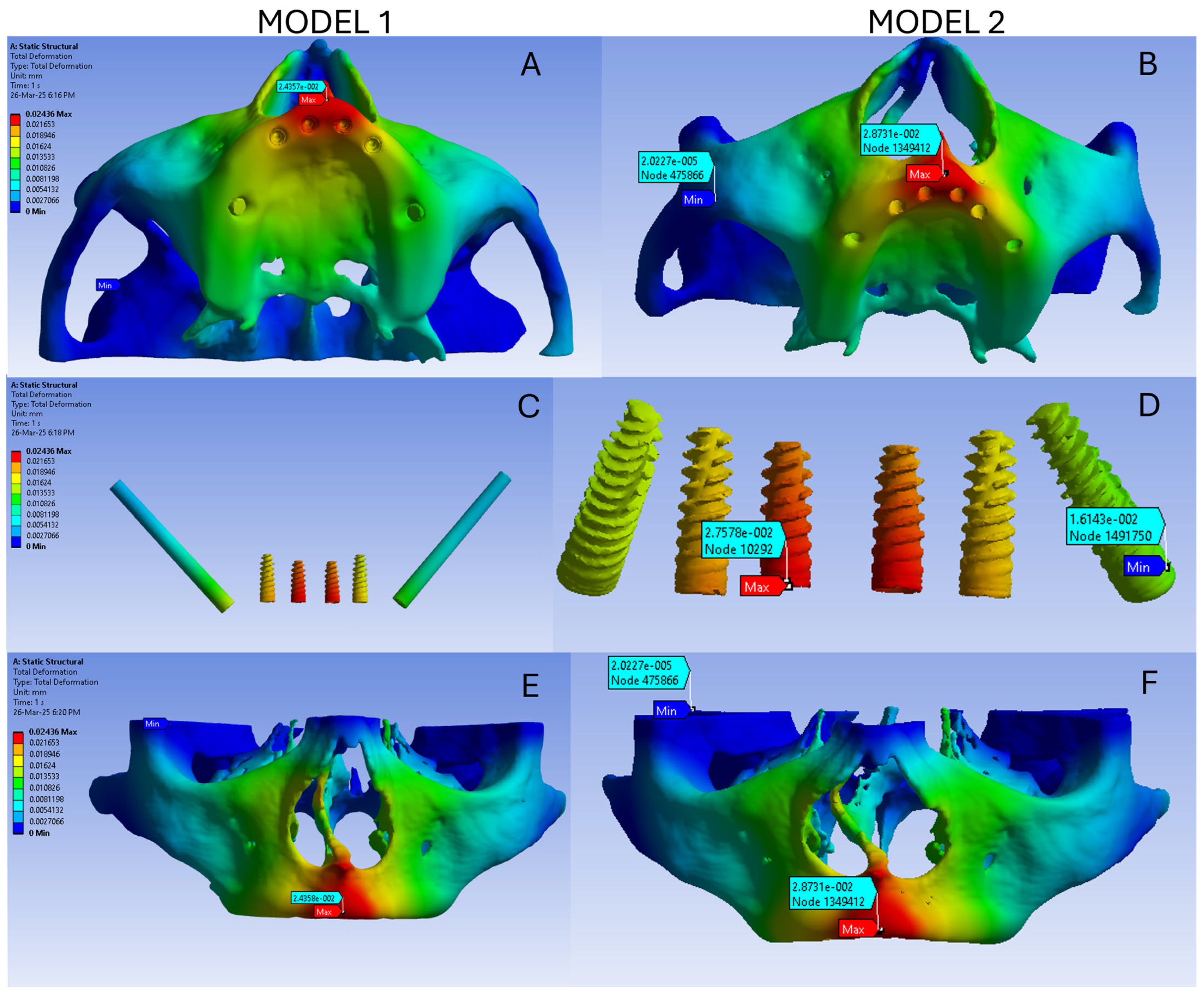 Biomechanical Comparative Evaluation of Atrophic Edentulous Maxilla ...
