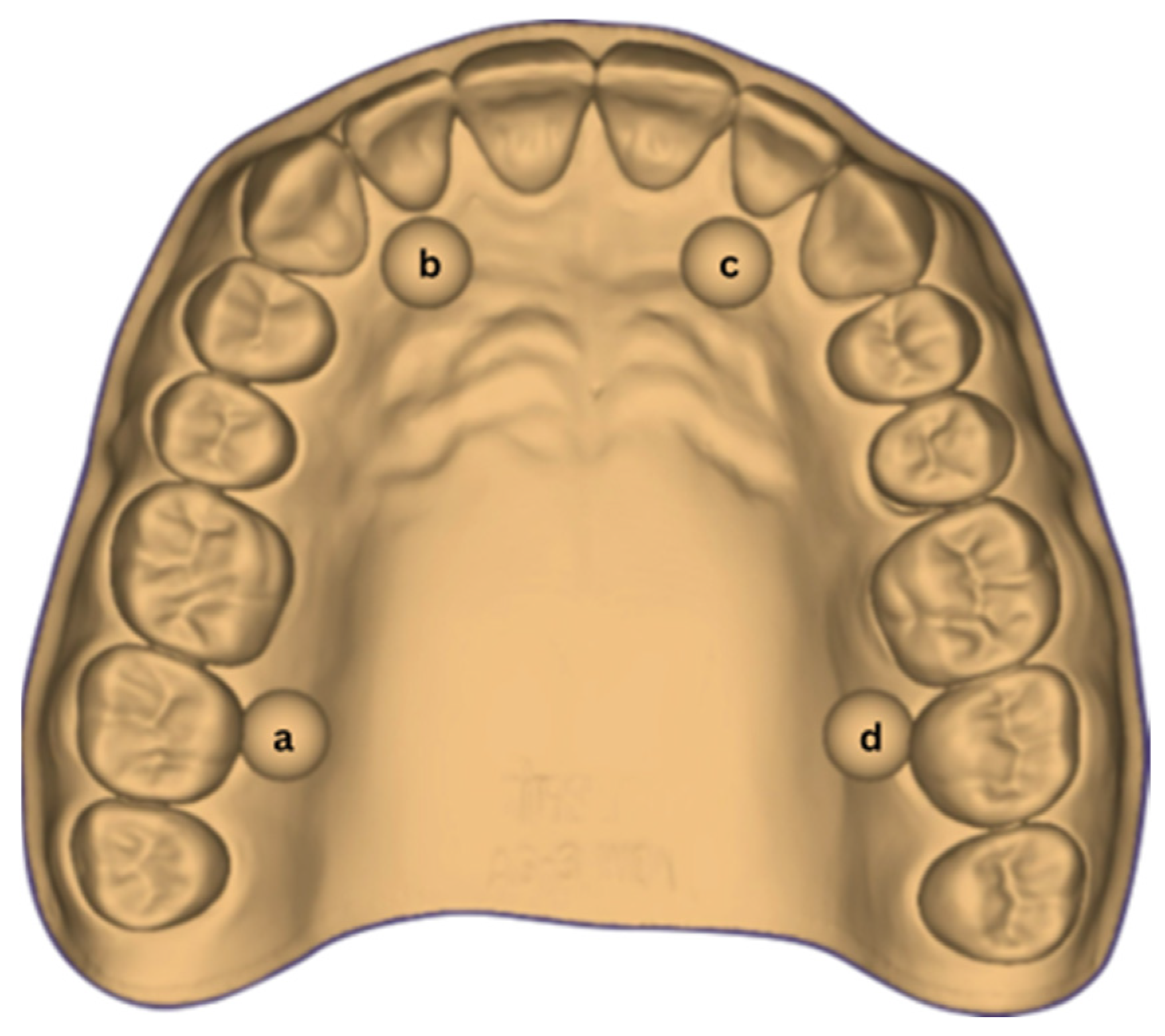 In Vitro Accuracy Analysis of Intraoral Scanning Strategies: A ...