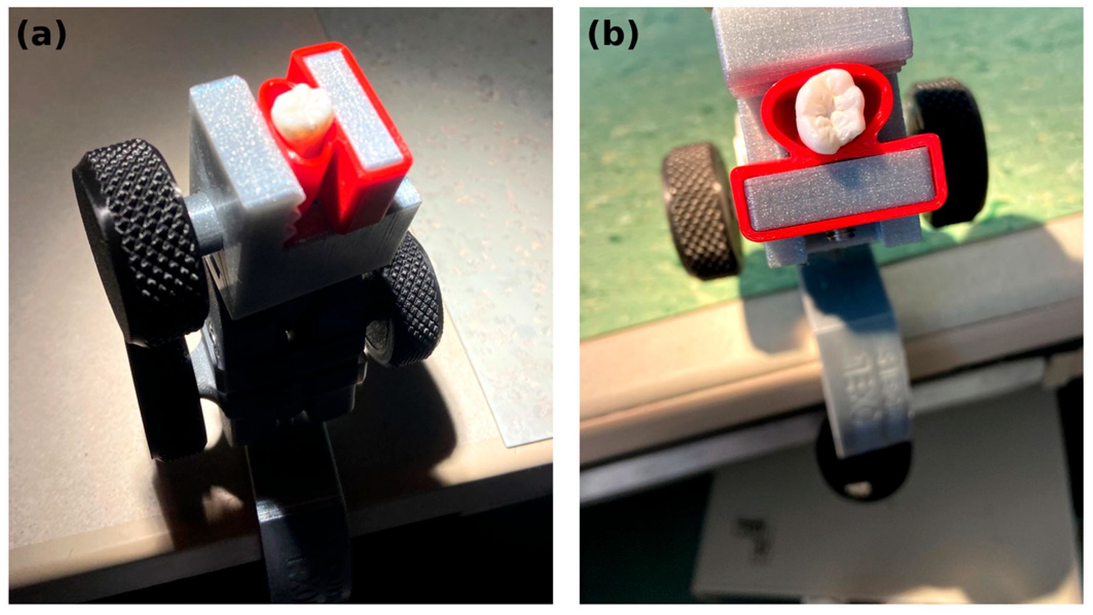 Marginal Fit of Chairside CAD/CAM Ceramic Inlays: An In Vitro SEM Study