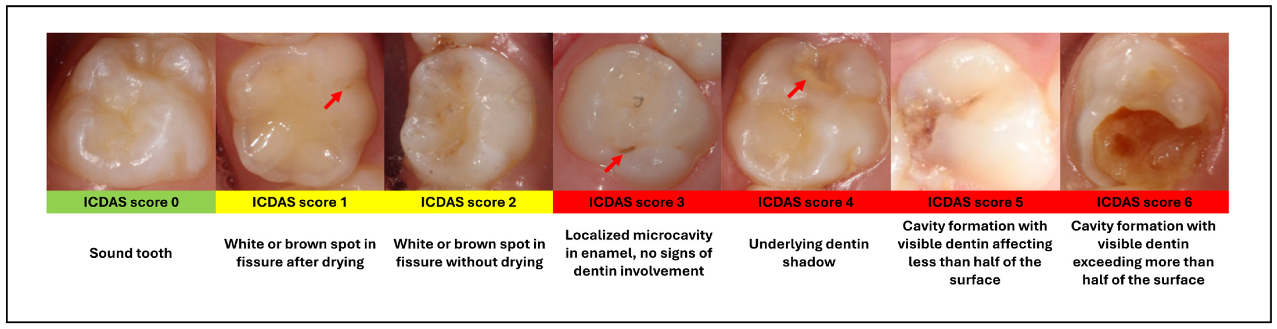 Feeding Practices, Prenatal Oral Health Information, and Early ...