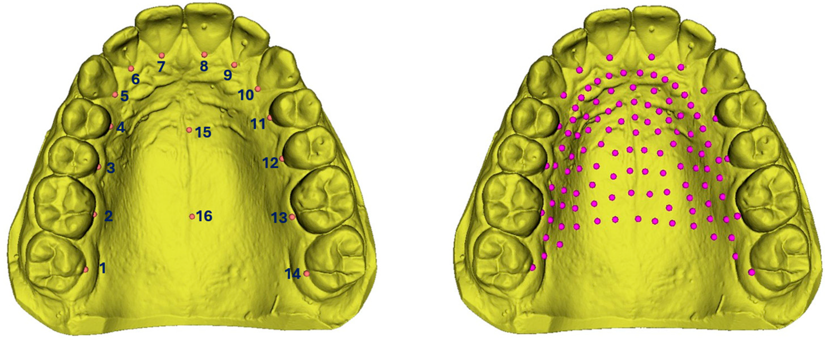 Three-Dimensional Variation of the Human Hard Palate Across Populations ...