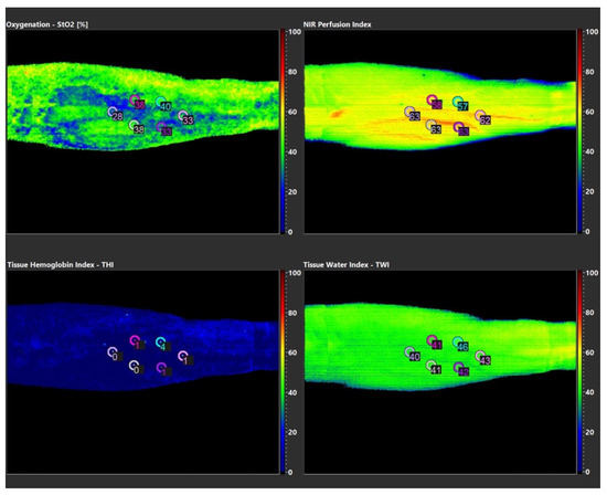 Long-Term Risk Assessment for Medical Application of Cold Atmospheric ...