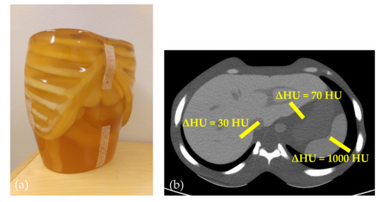 Spatial Distribution of Noise Reduction in Four Iterative Reconstruction Algorithms in CT—A ...