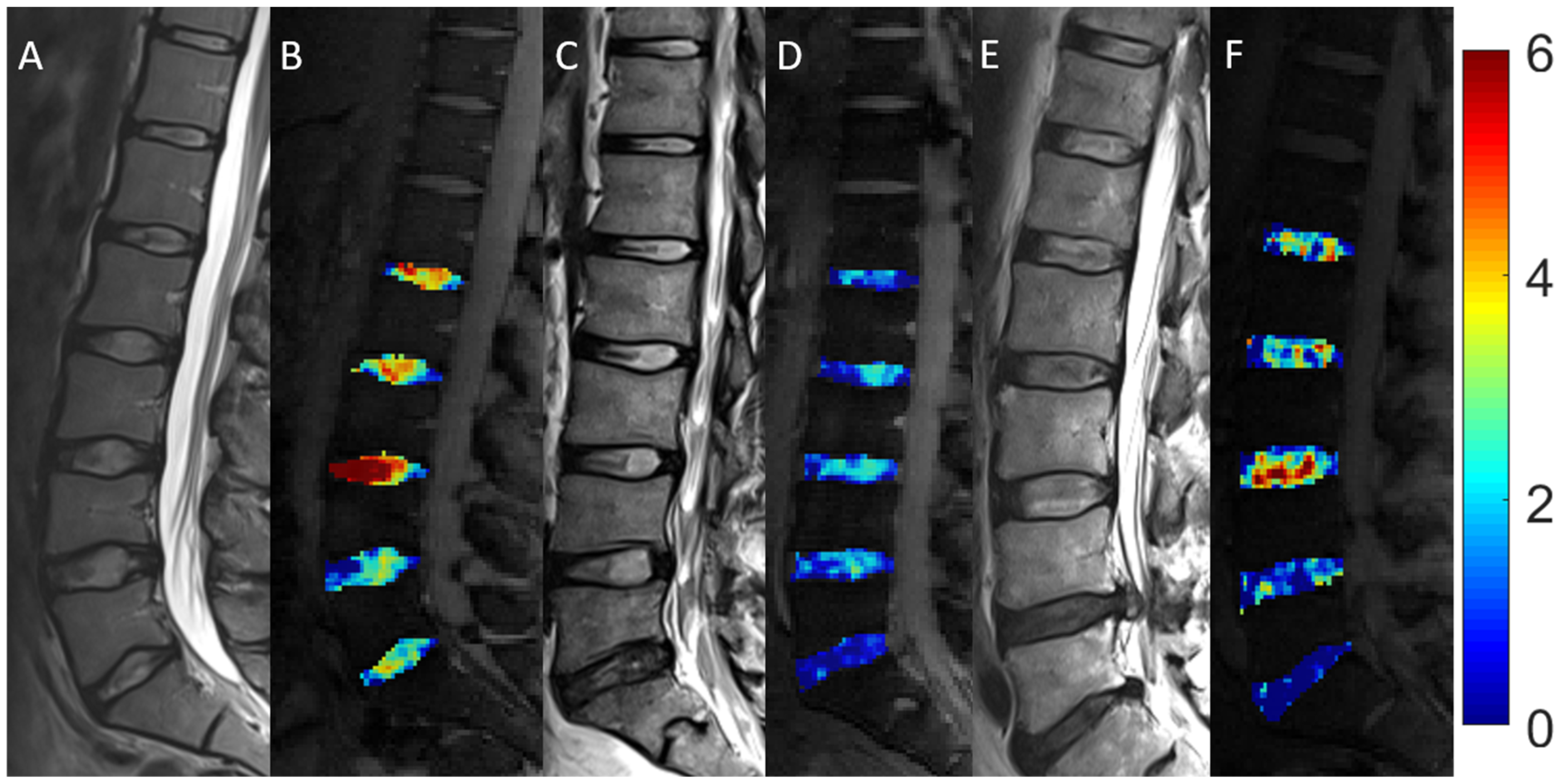 Non Specific Low Back Pain And Lumbar Radiculopathy Comparison Of Non Specific Low Back Pain And Lumbar Radiculopathy Comparison Of