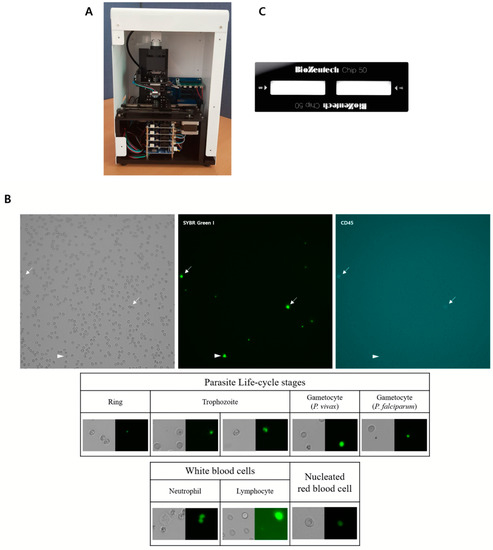 An Automated Microscopic Malaria Parasite Detection System Using ...