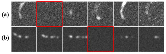 Generation of Augmented Capillary Network Optical Coherence Tomography ...
