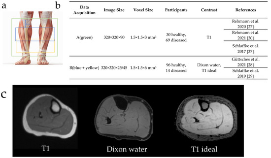 3D Automated Segmentation of Lower Leg Muscles Using Machine Learning ...