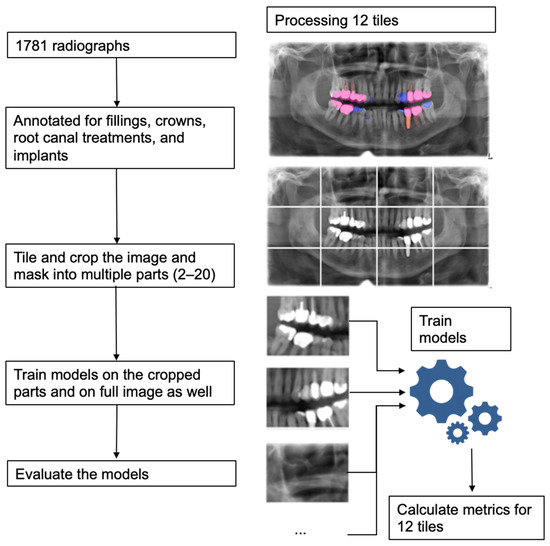 Segmentation of Dental Restorations on Panoramic Radiographs Using Deep ...
