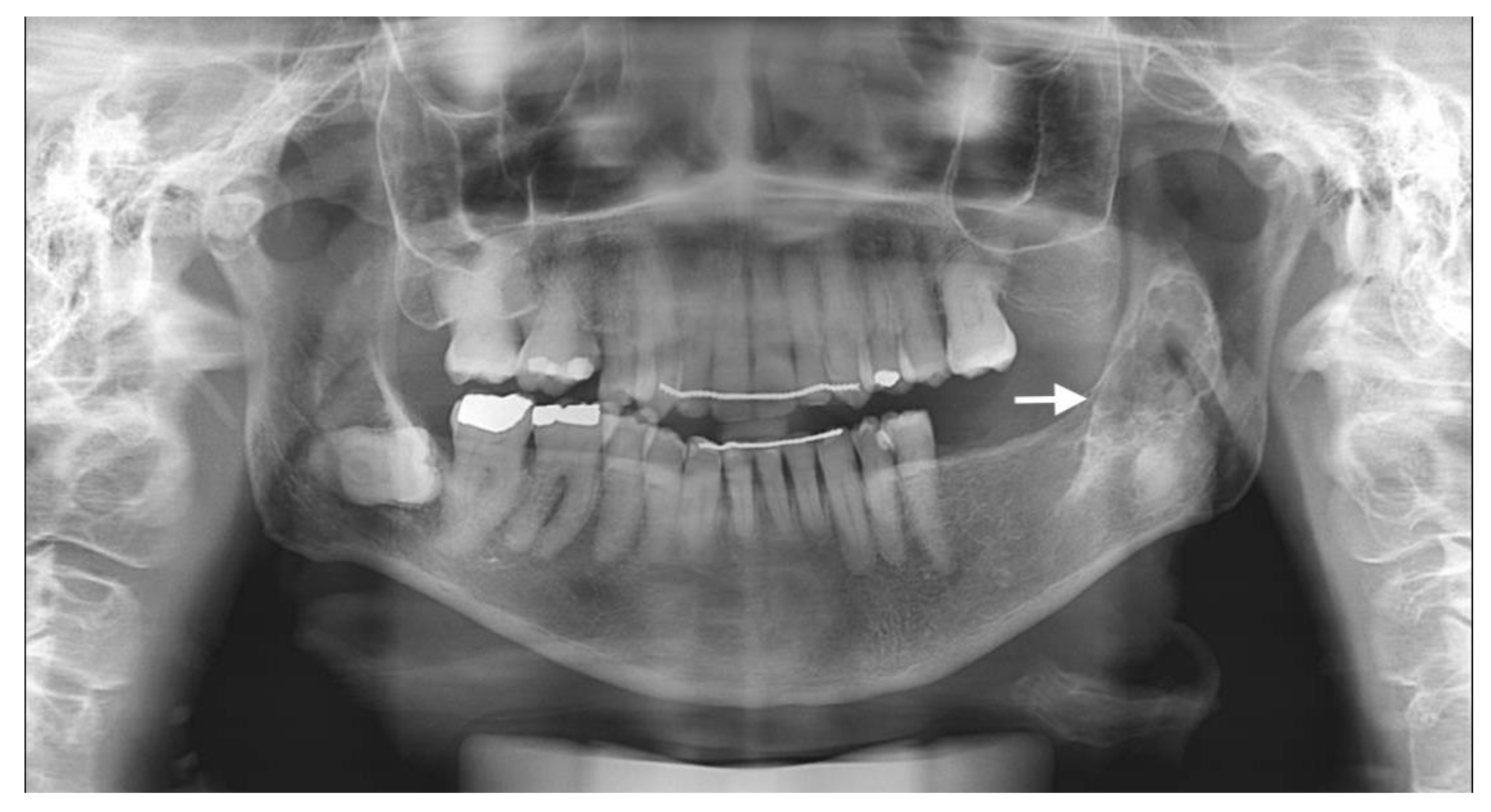 Diagnostics Free Full Text Mandibular Radiolucencies A Diagnostics Free Full Text Mandibular Radiolucencies A