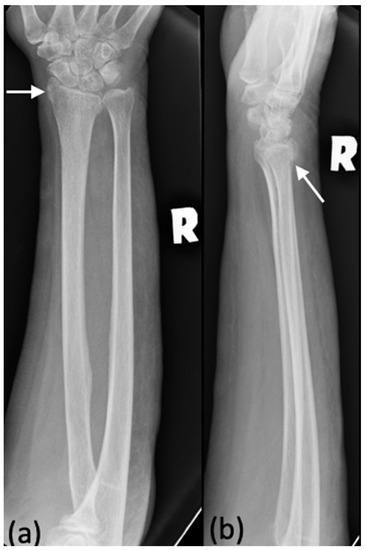 An Evaluation of the Quality of Plain Radiograph Interpretations by ...