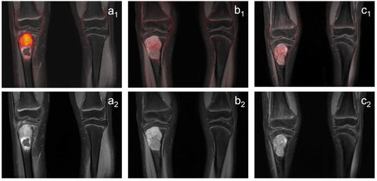 Utility of Integrated PET/MRI for the Primary Diagnostic Work-Up of ...