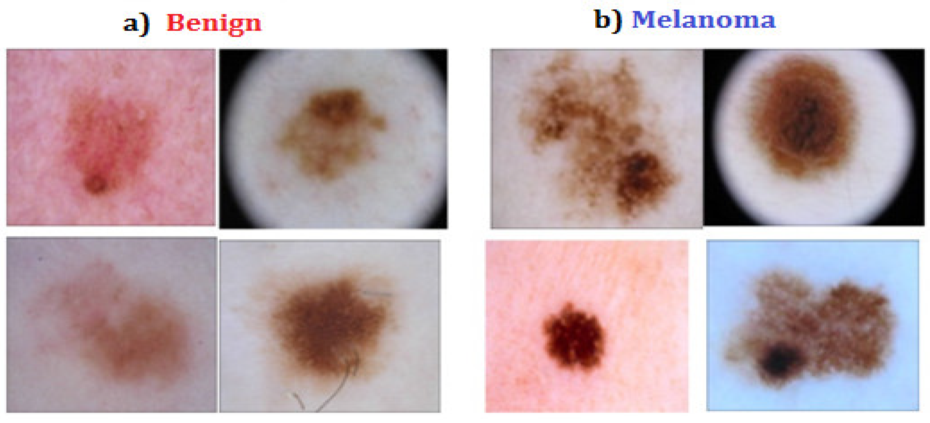 Diagnostics Free Full Text Automatic Malignant And Benign Skin Diagnostics Free Full Text Automatic Malignant And Benign Skin