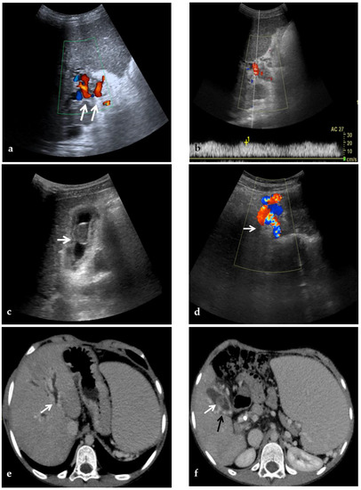 Diagnostics | Special Issue : Advances in Image-Guided Diagnosis and ...
