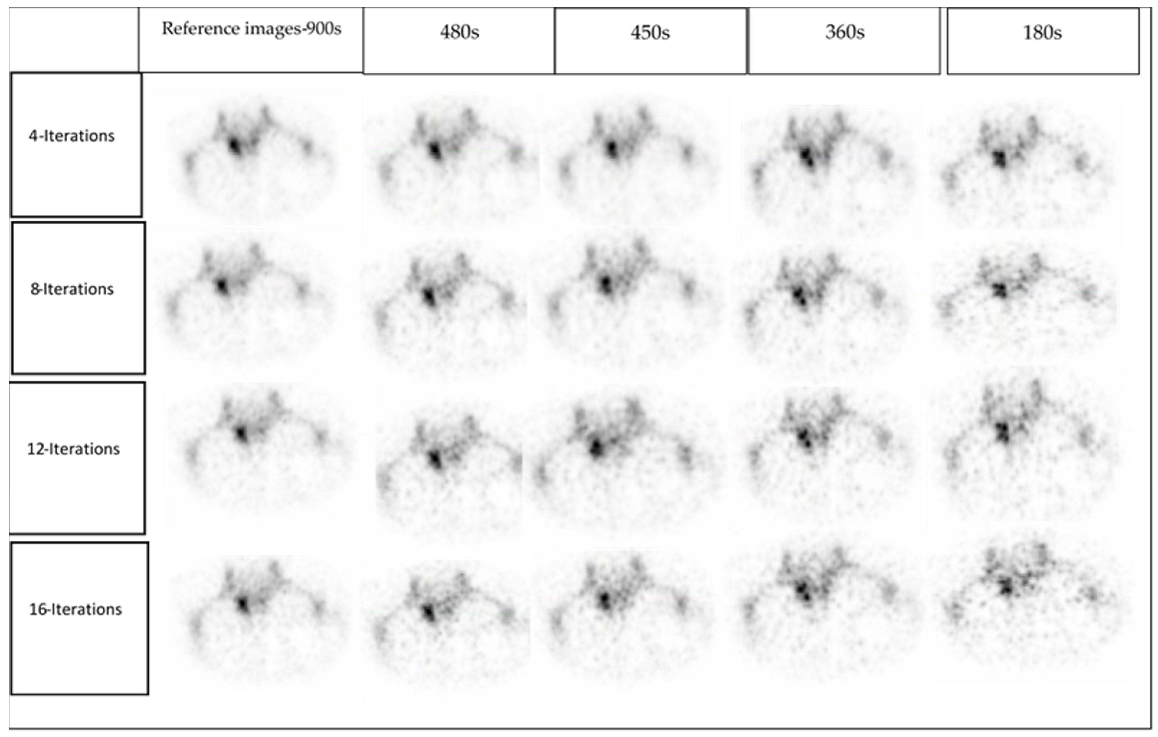 Diagnostics Free Full Text Transition To Fast Whole Body SPECT CT Diagnostics Free Full Text Transition To Fast Whole Body SPECT CT