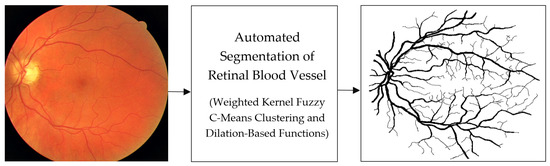 Retinal Blood-Vessel Extraction Using Weighted Kernel Fuzzy C-Means ...