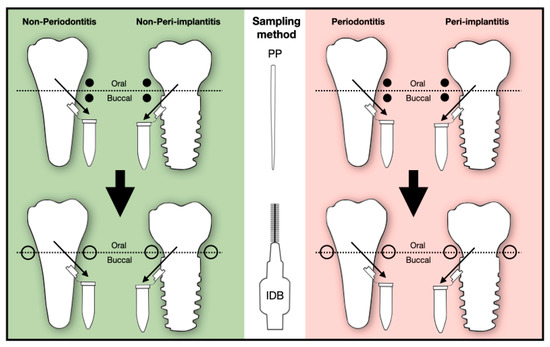 Diagnostics | Free Full-Text | Microbial Sampling Using Interdental ...